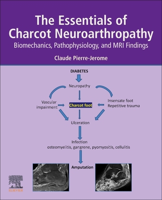 The Essentials of Charcot Neuroarthropathy: Biomechanics ...