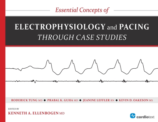 Essential Concepts of Electrophysiology and Pacing through Case Studies ...