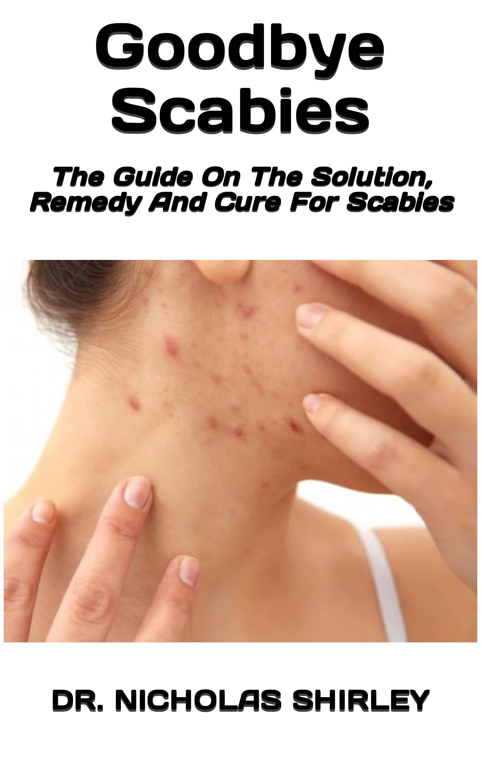 Goodbye Scabies : The Guide On The Solution, Remedy And Cure For ...