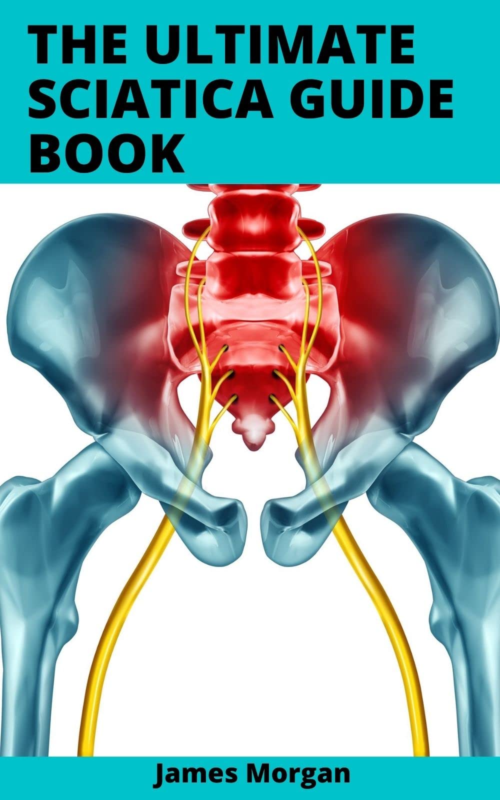The Ultimate Sciatica Guide Book: Exercises To Reduce Physical Pain And ...