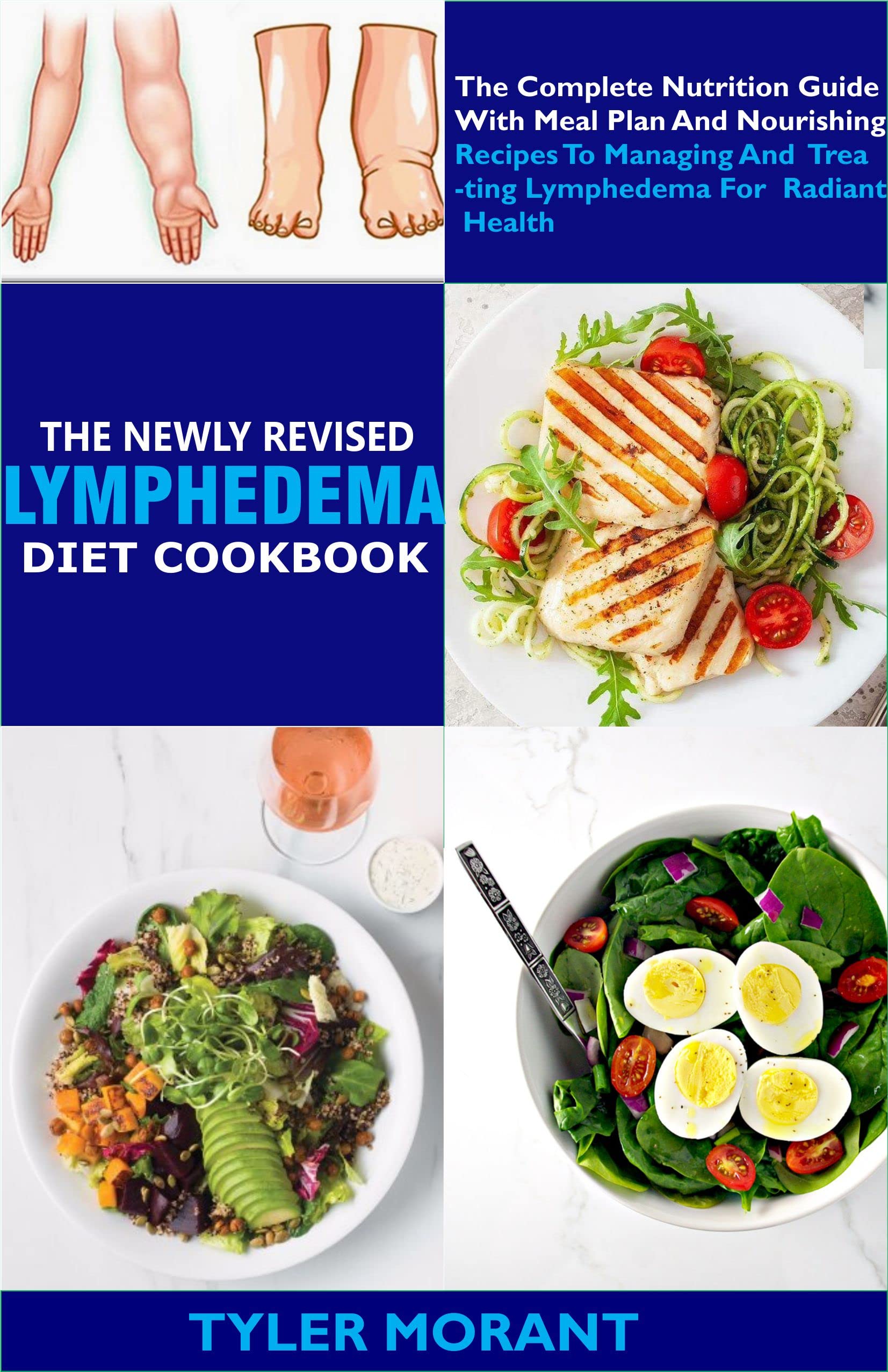 The Newly Revised Lymphedema Diet Cookbook: The Complete Nutrition ...