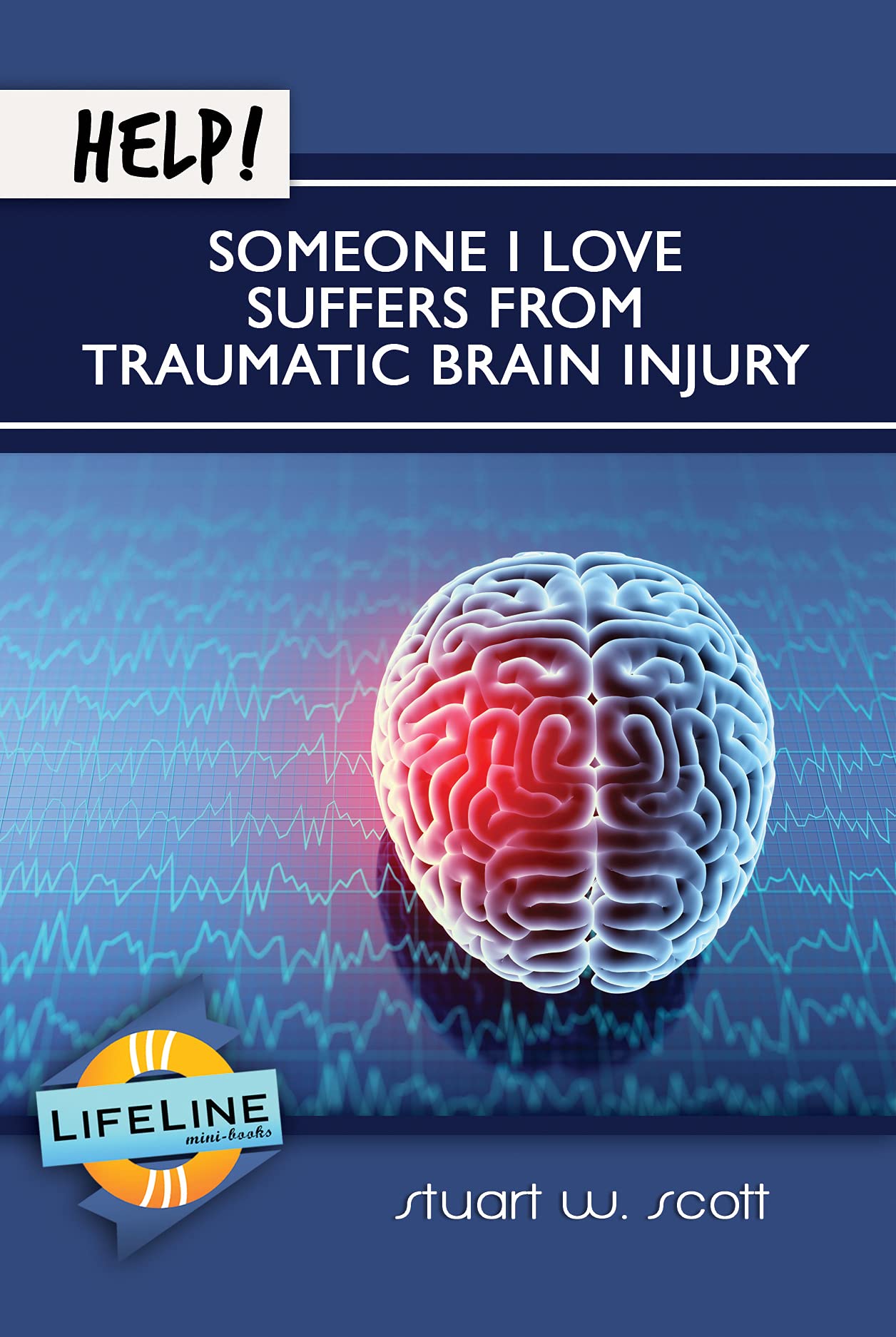 Help! Someone I Love Suffers from Traumatic Brain Injury by Stuart W ...