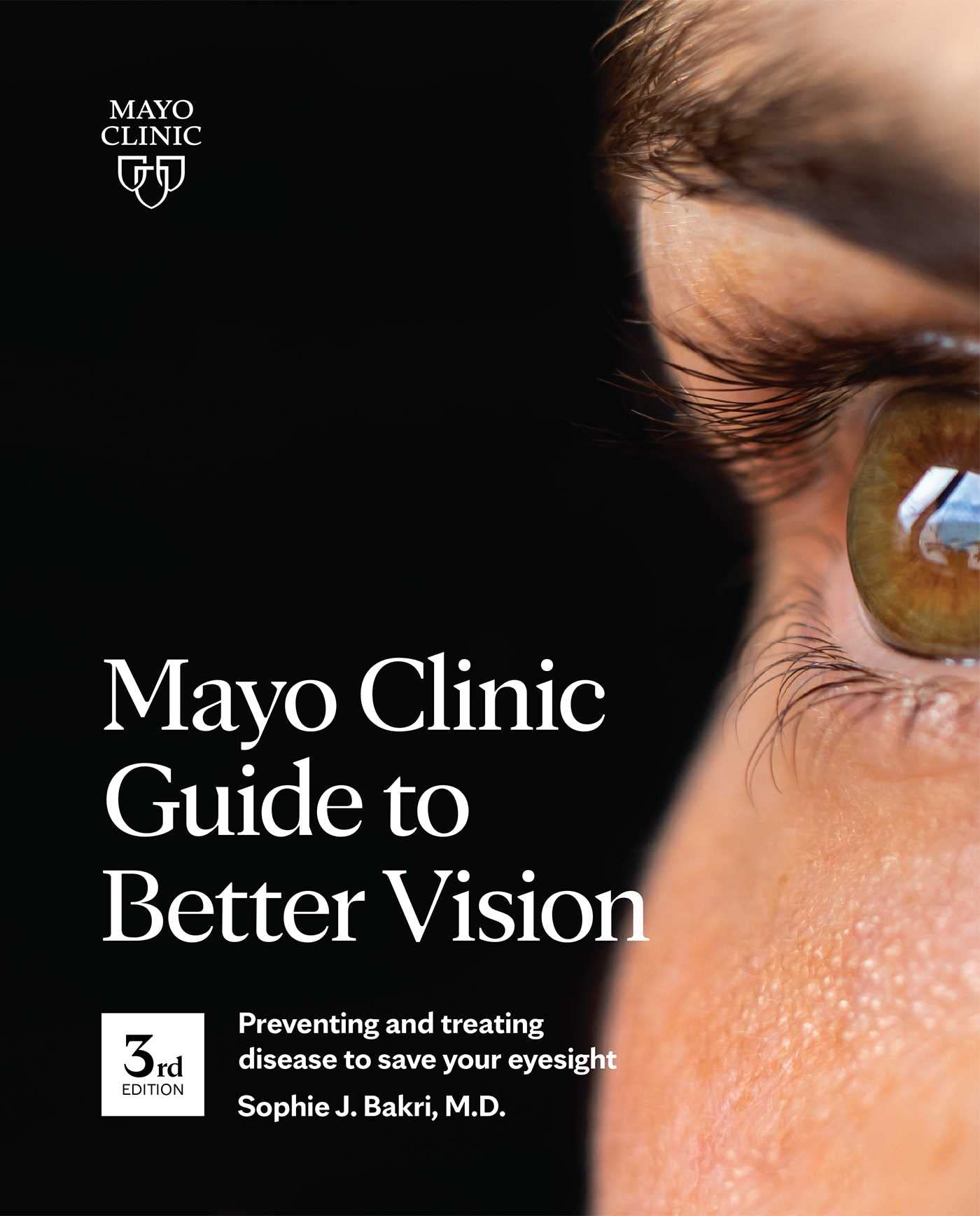 Mayo Clinic Guide To Better Vision, 3rd Ed: Preventing and treating ...