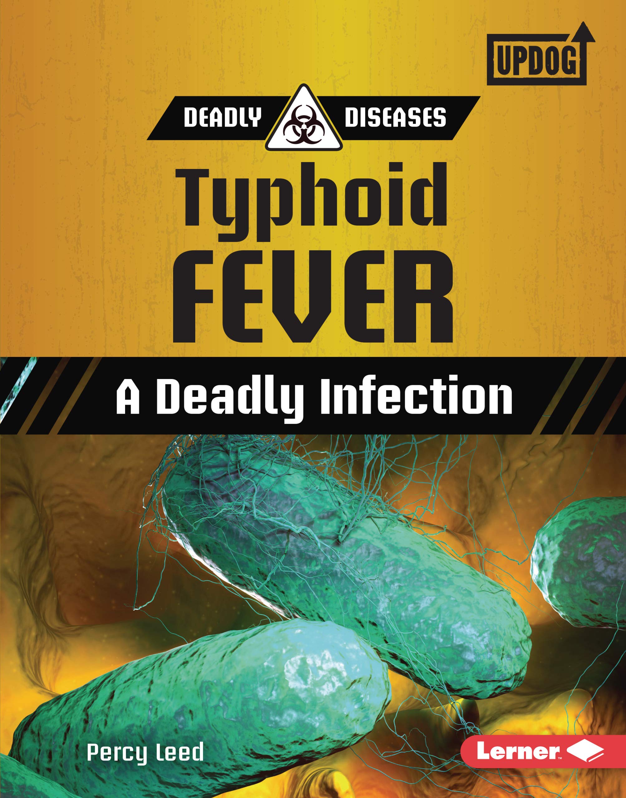 Typhoid Fever: A Deadly Infection (Deadly Diseases by Percy Leed ...