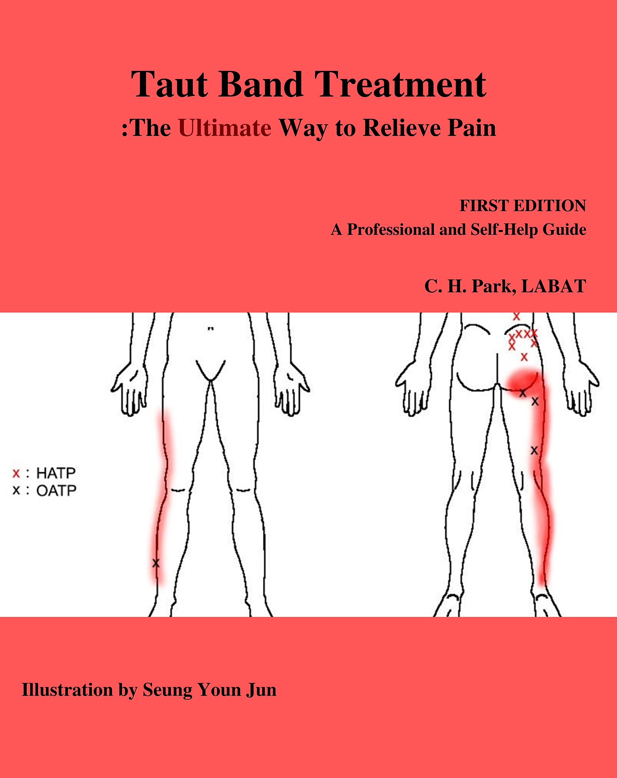 Taut Band Treatment: The Ultimate Way to Relieve Pain by C. H. Park ...