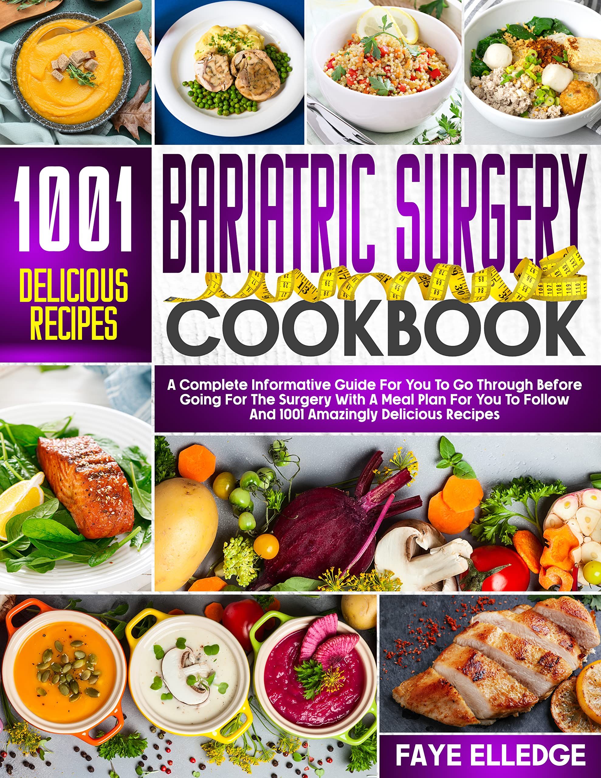 Bariatric Surgery Cookbook: A Complete Informative Guide for You to Go ...