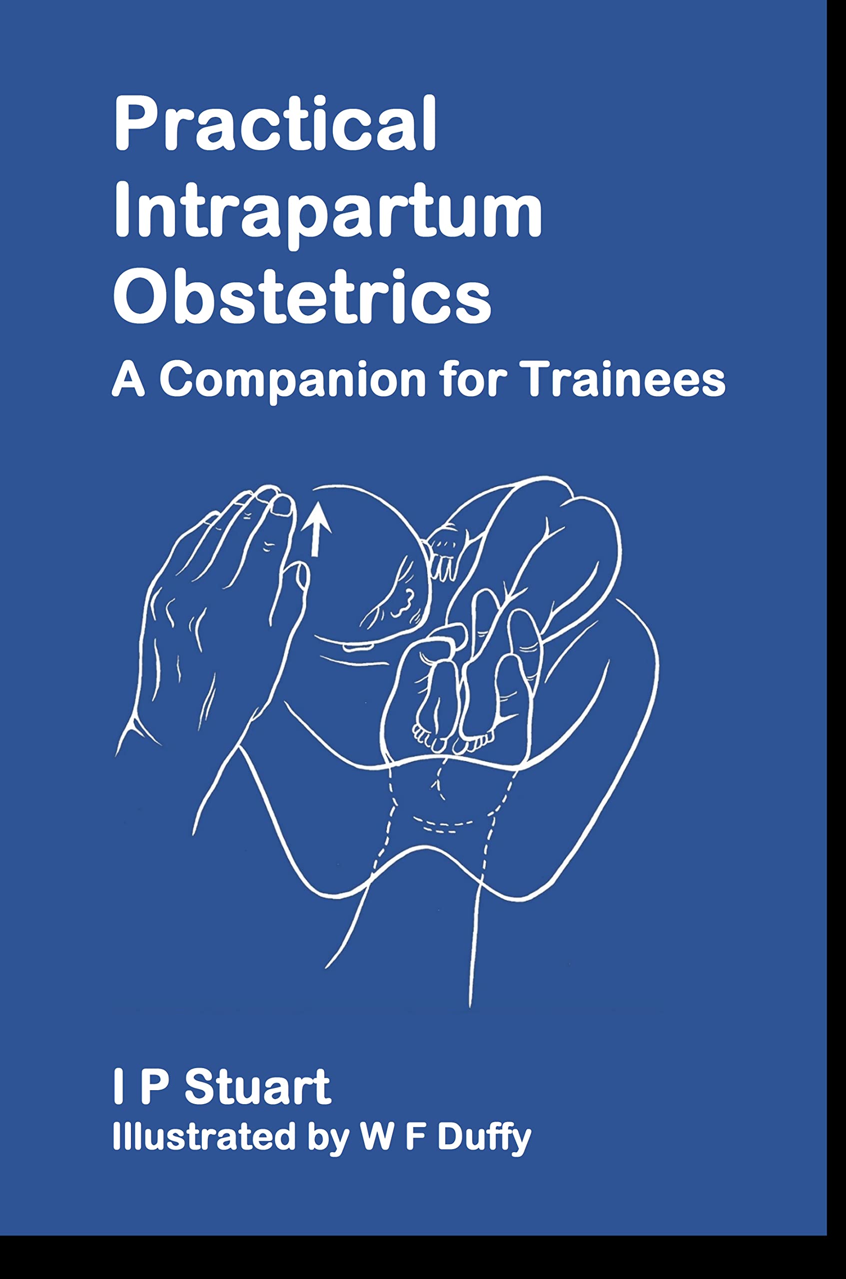 Practical Intrapartum Obstetrics: A Companion for Trainees by Ian Peter ...