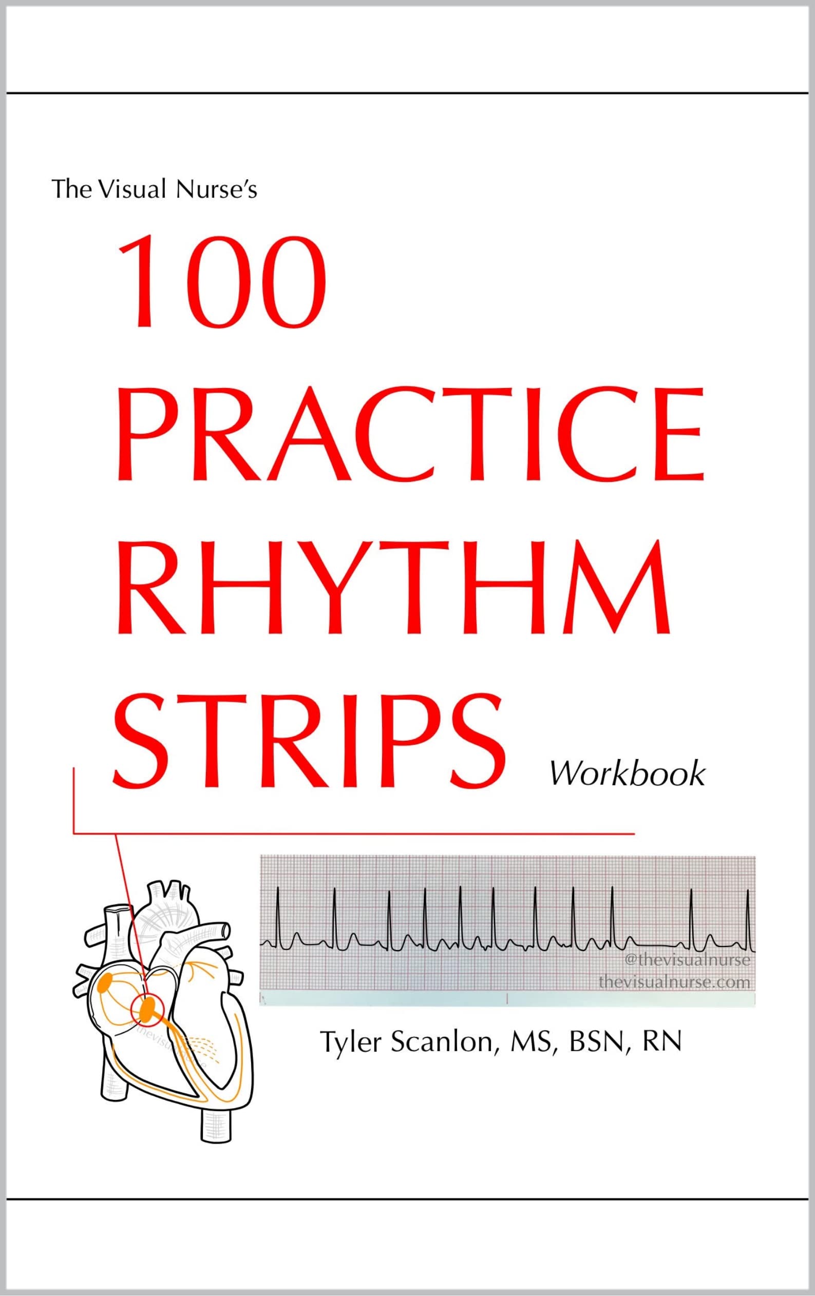 The Visual Nurse's 100 Practice Rhythm Strips Workbook by Tyler Scanlon ...