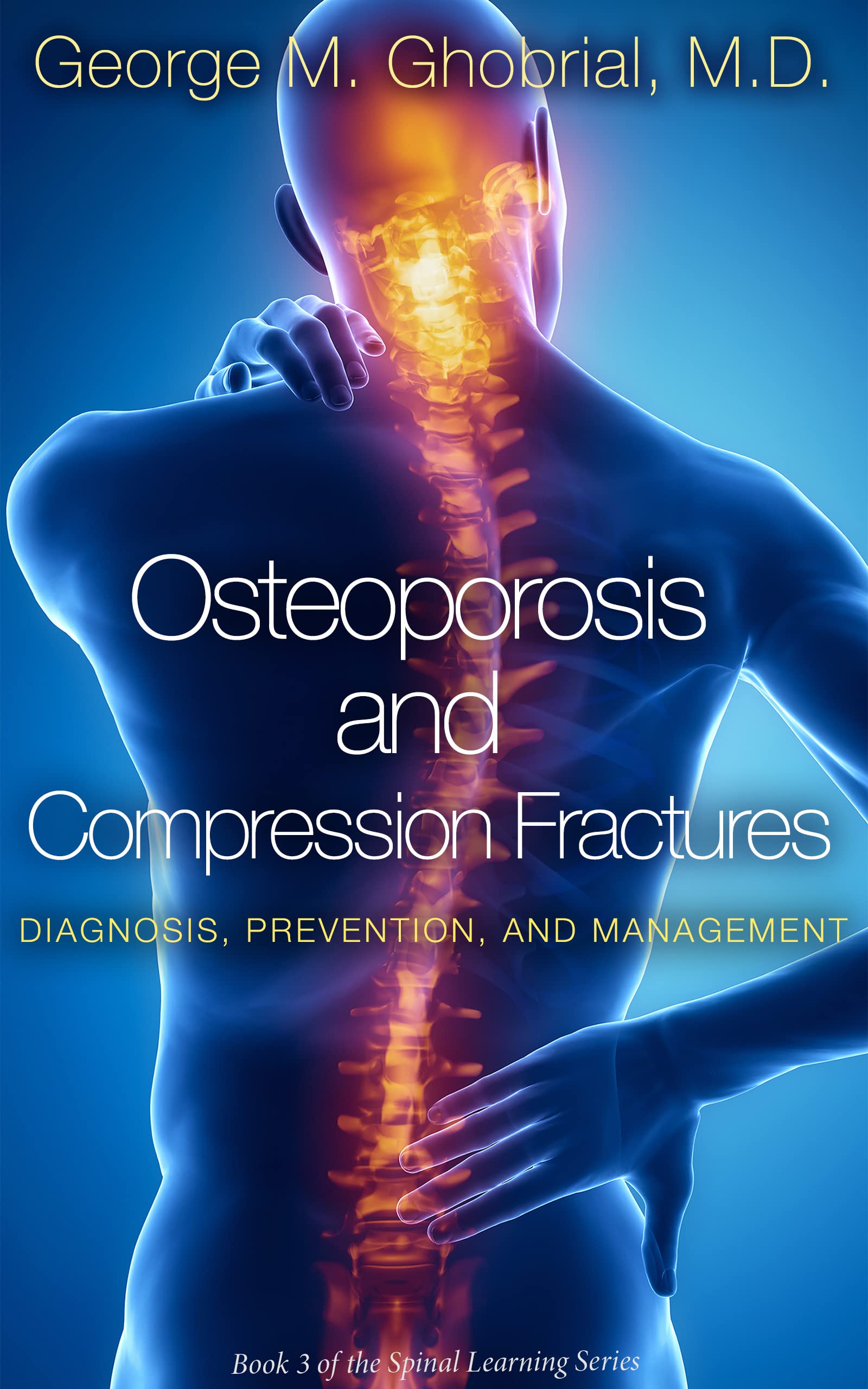 Osteoporosis and Compression Fractures: Diagnosis, Prevention, and ...
