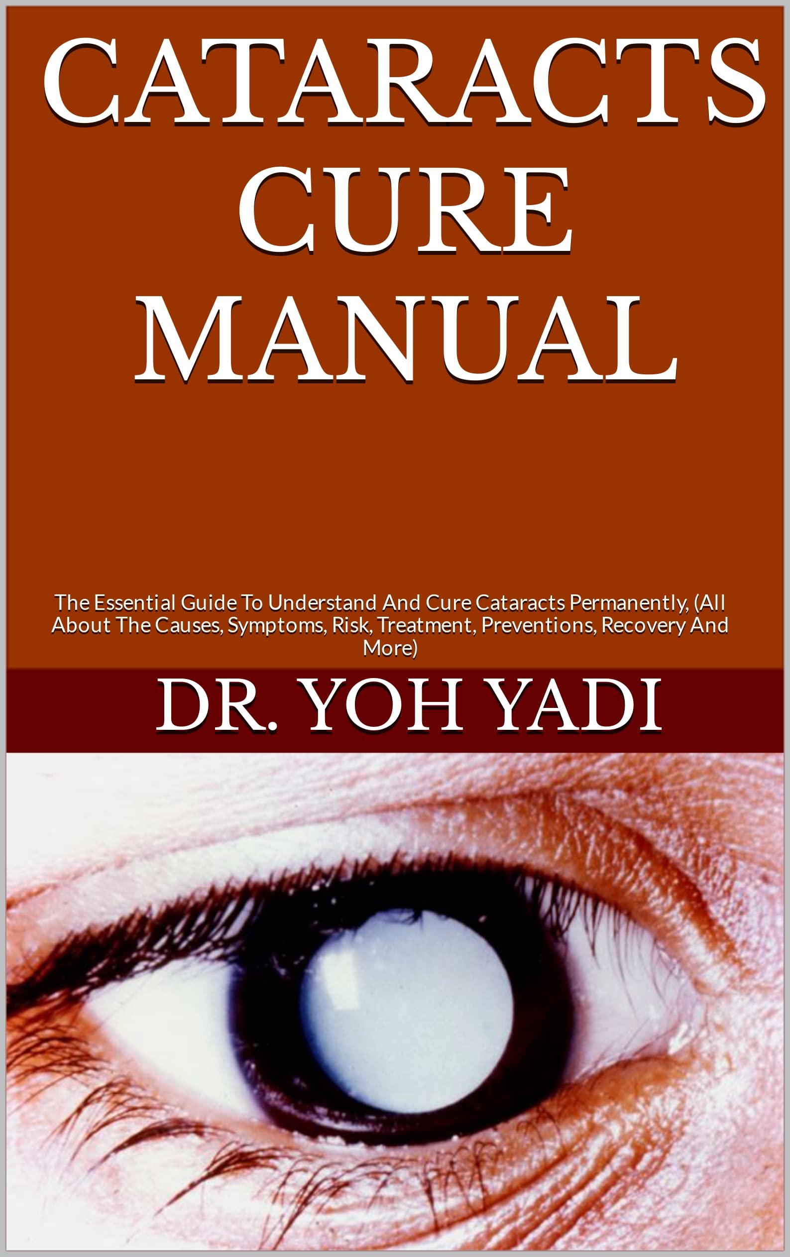 CATARACTS CURE MANUAL : The Essential Guide To Understand And Cure ...