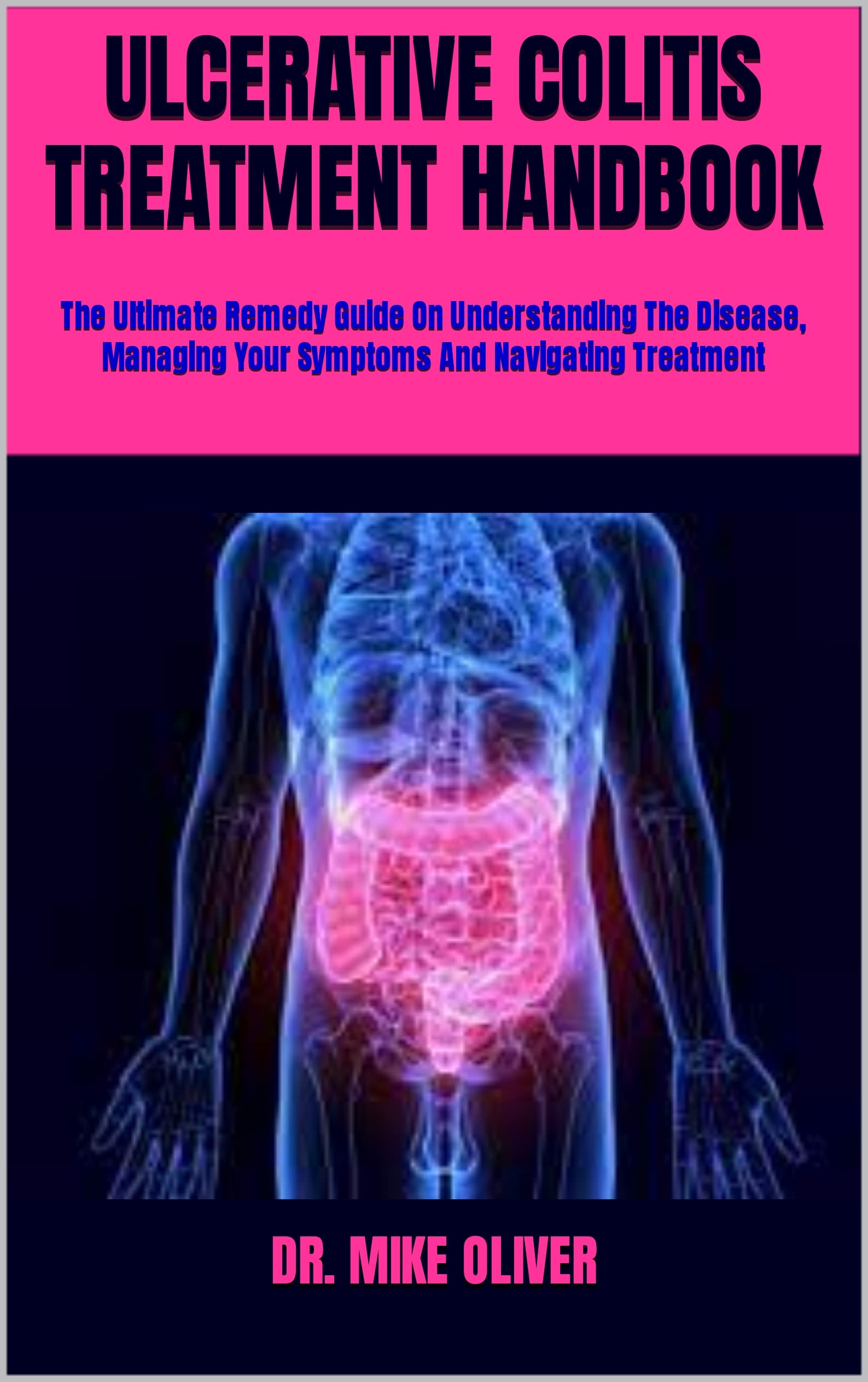 ULCERATIVE COLITIS TREATMENT HANDBOOK: The Ultimate Remedy Guide On ...