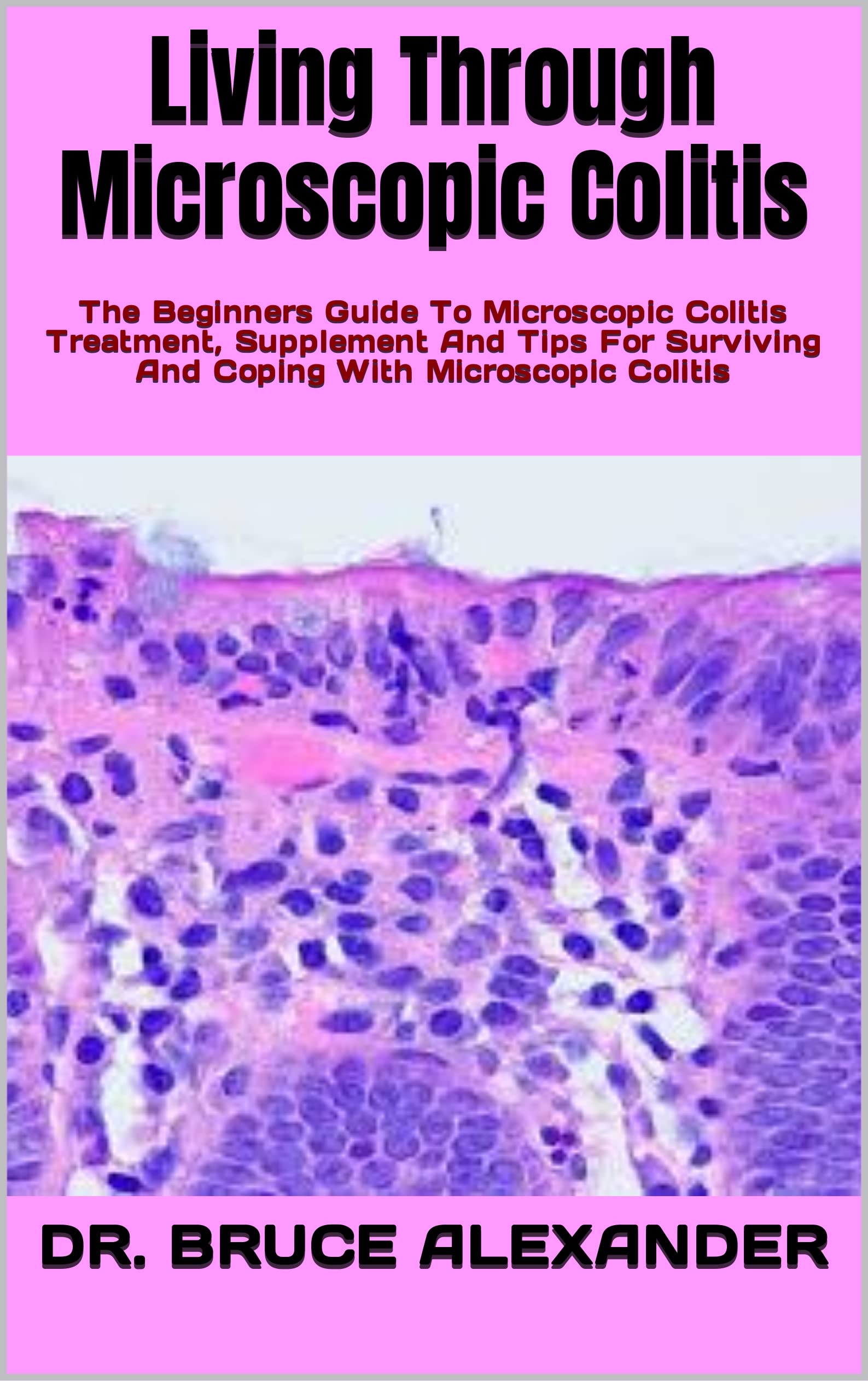 Living Through Microscopic Colitis : The Beginners Guide To Microscopic ...