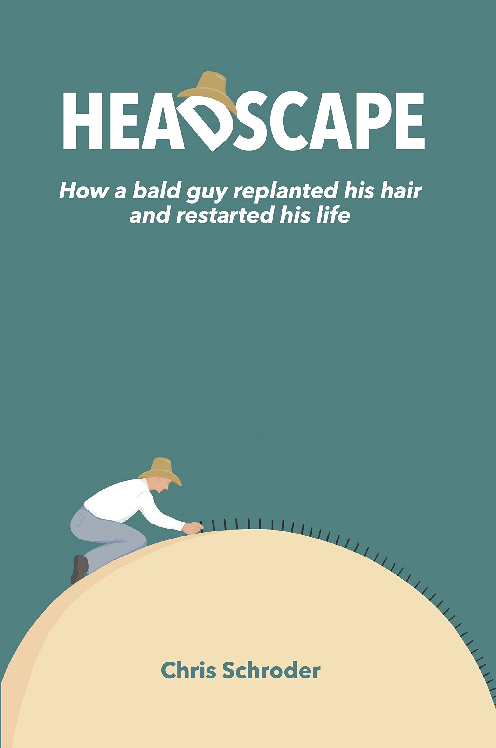 Headscape: How a bald guy replanted his hair and restarted his life by ...