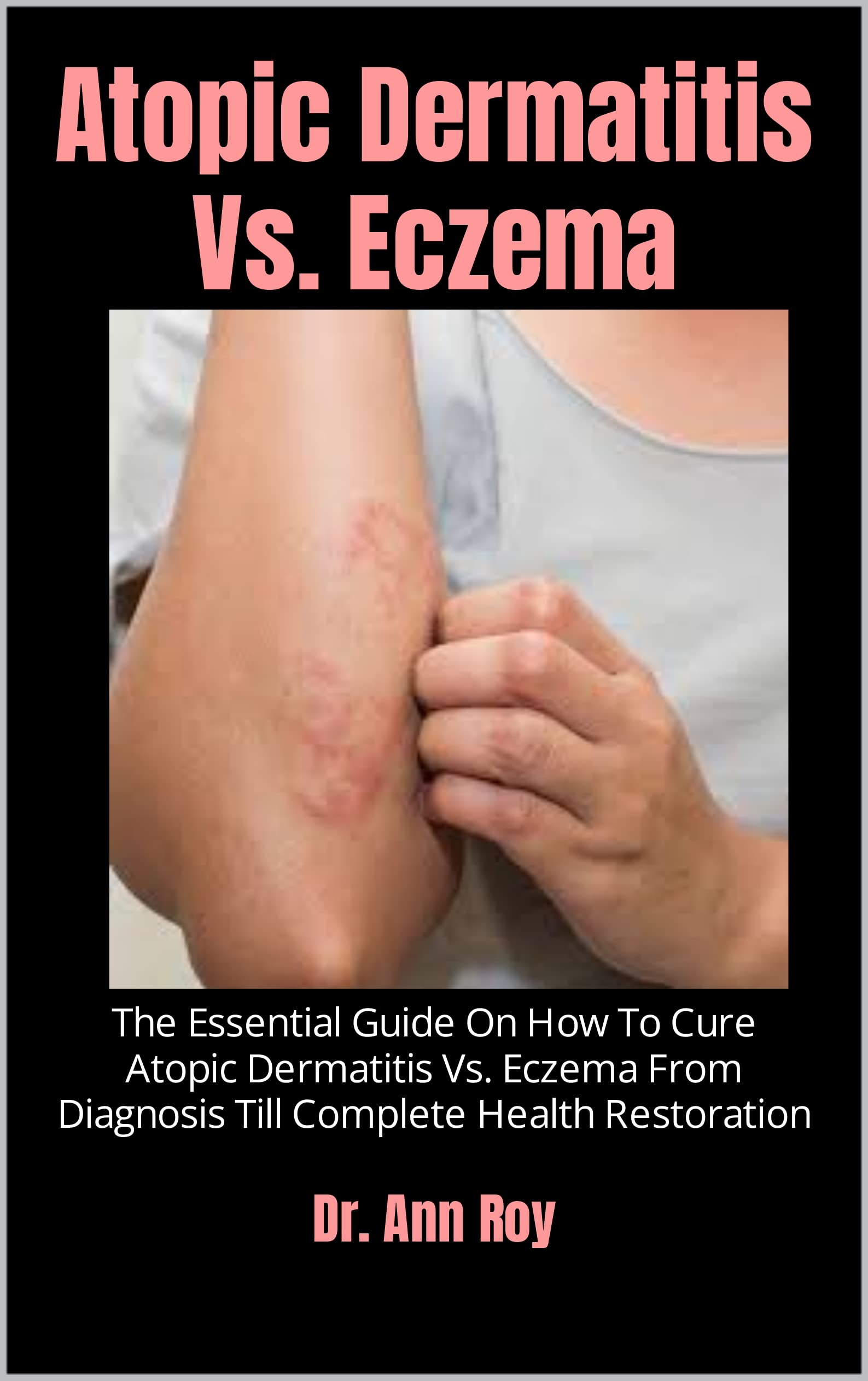 Atopic Dermatitis Vs. Eczema : The Essential Guide On How To Cure ...