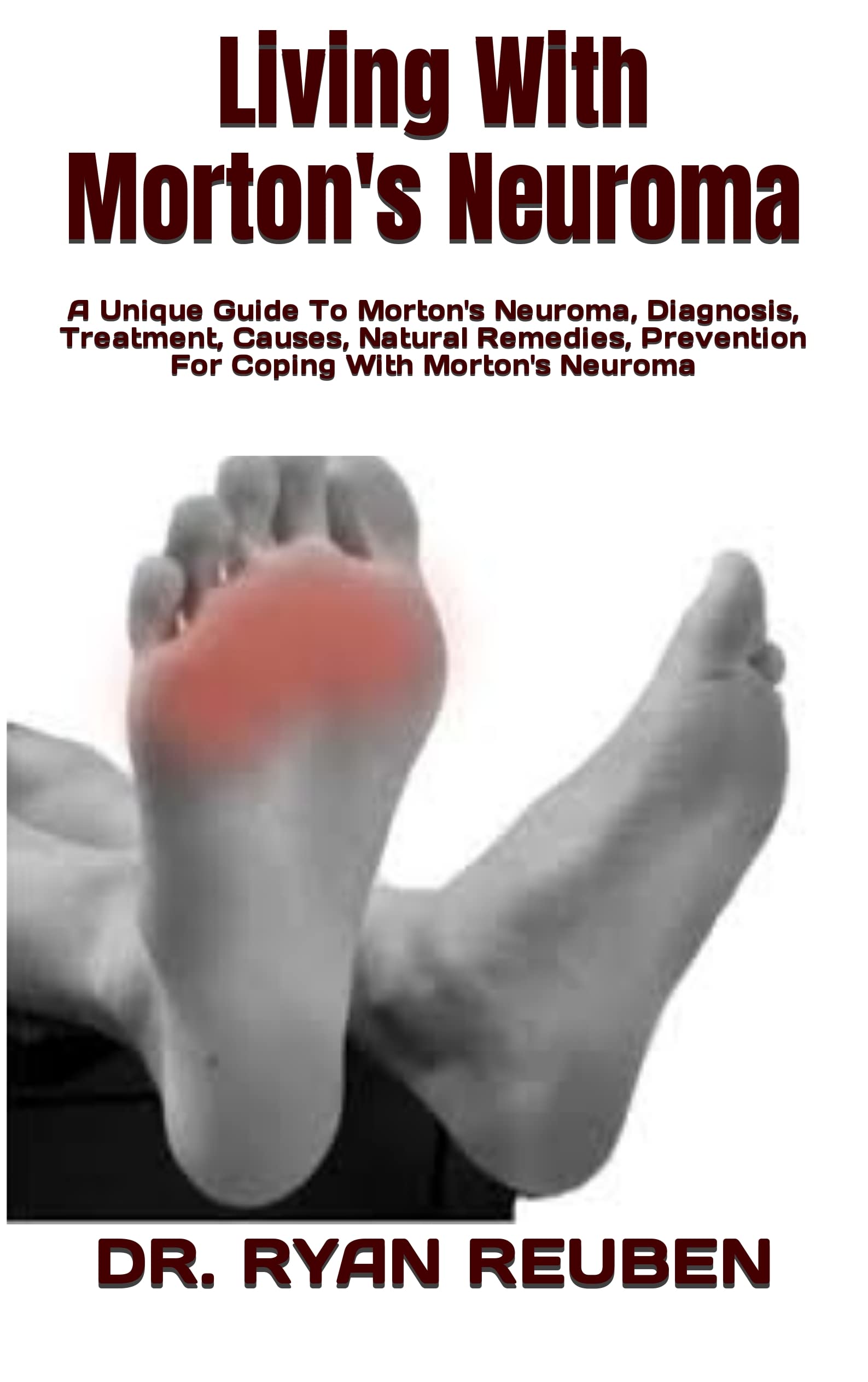Living With Morton's Neuroma: A Unique Guide To Morton's Neuroma ...