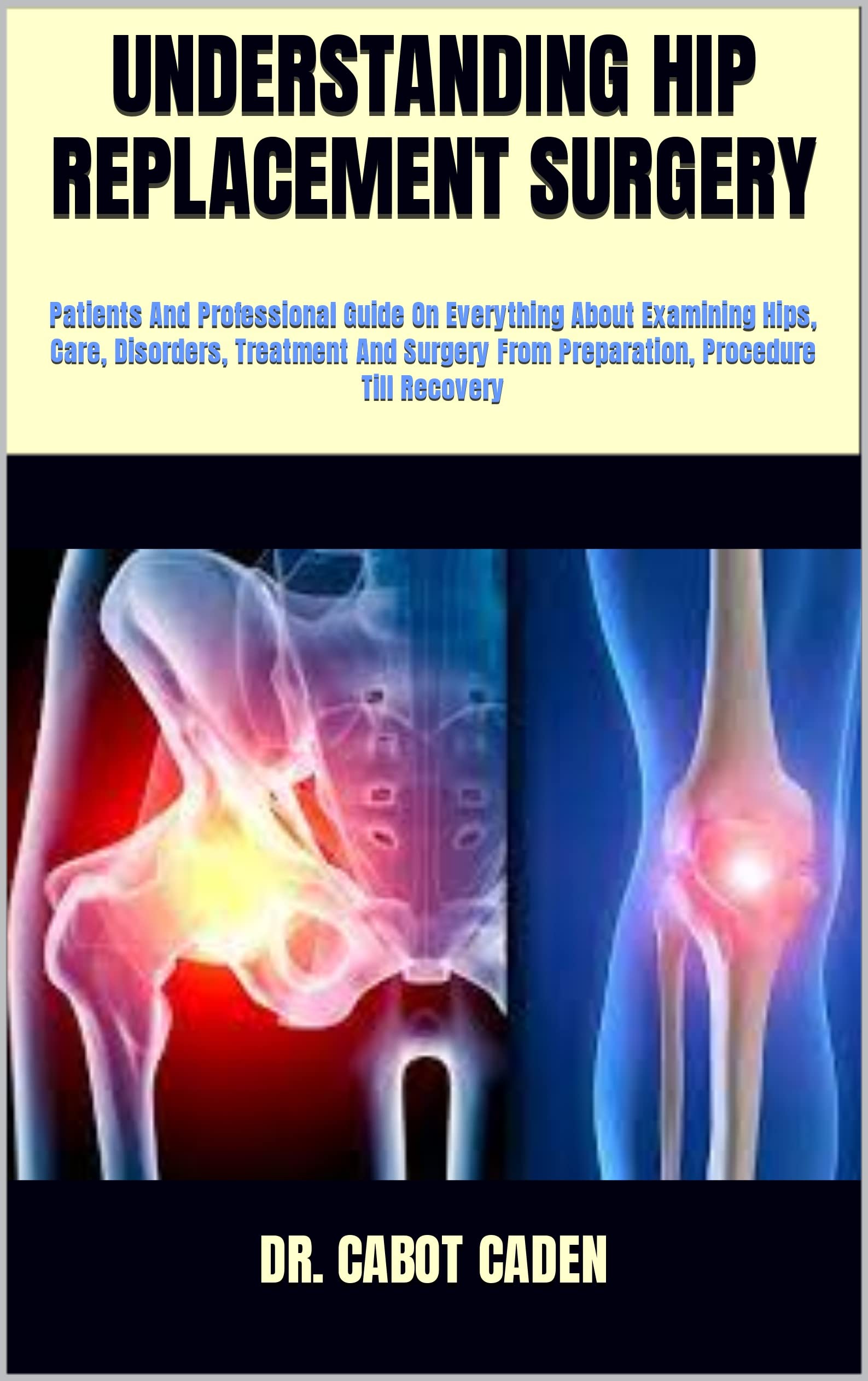 UNDERSTANDING HIP REPLACEMENT SURGERY : Patients And Professional Guide ...