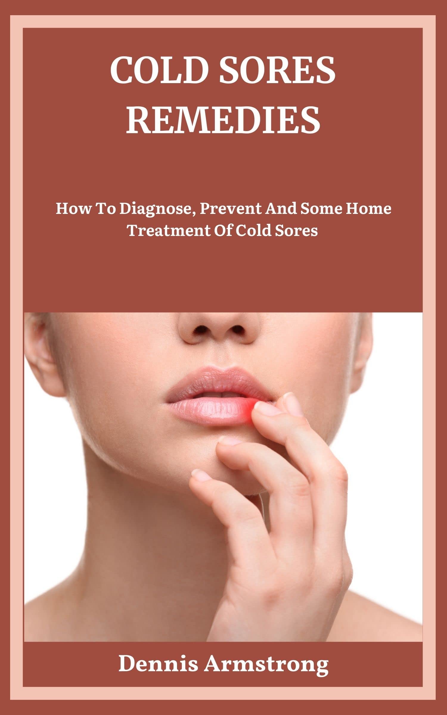 COLD SORES REMEDIES: How To Diagnose, Prevent And Some Home Treatment ...