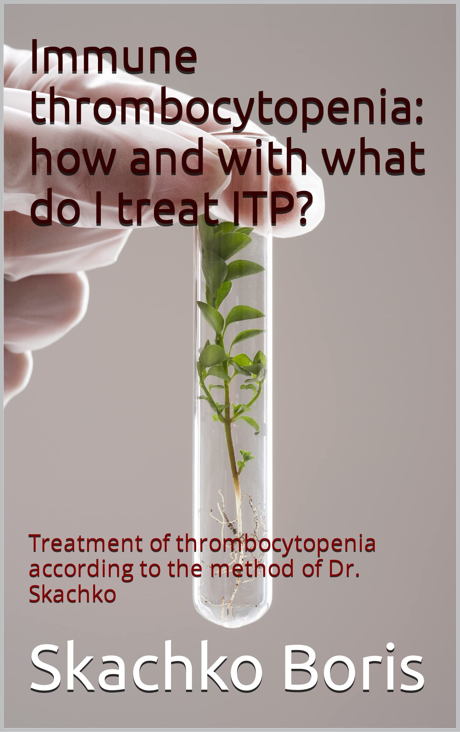 Immune thrombocytopenia: how and with what do I treat ITP?: Treatment ...