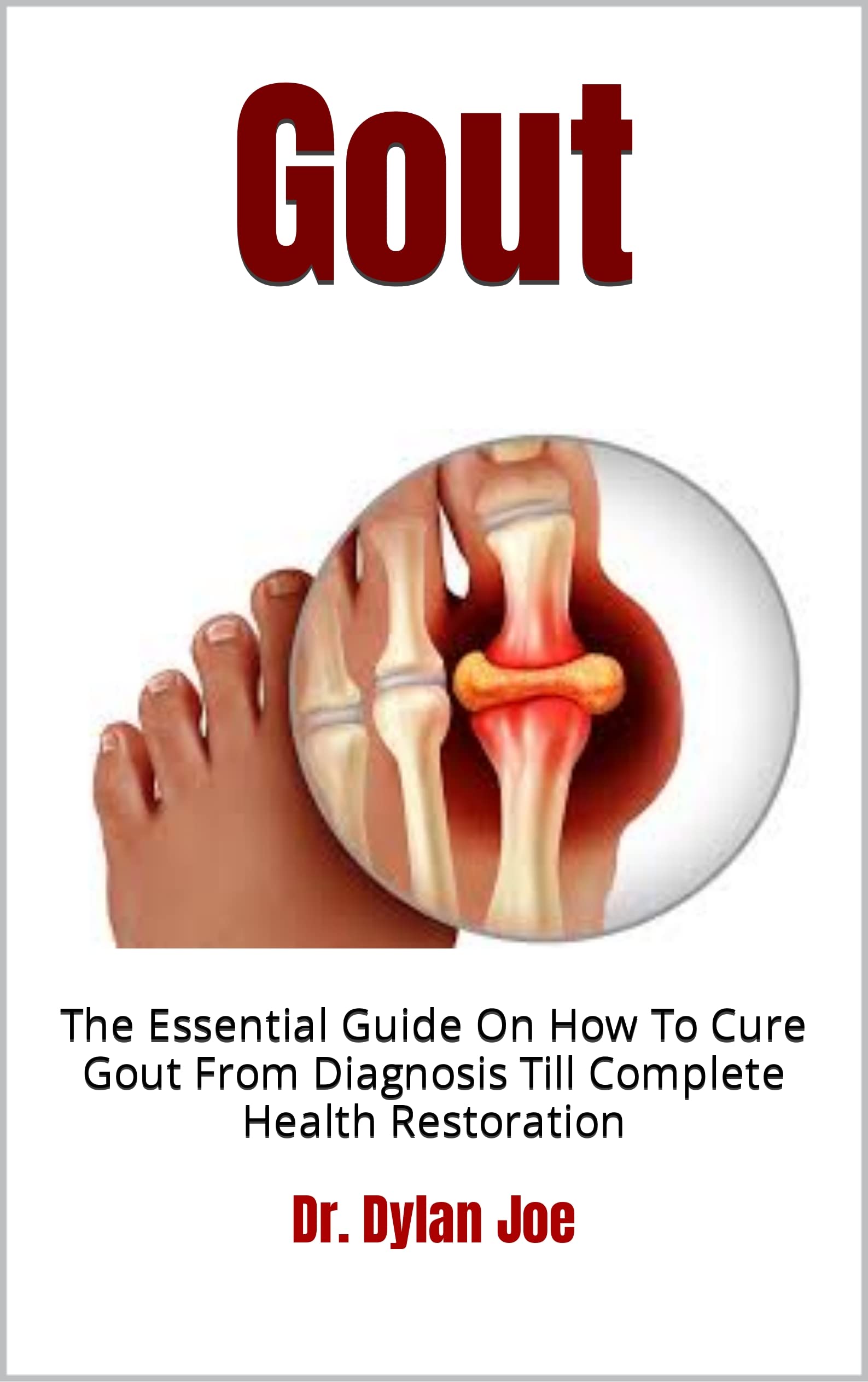 Gout : The Essential Guide On How To Cure Gout From Diagnosis Till ...