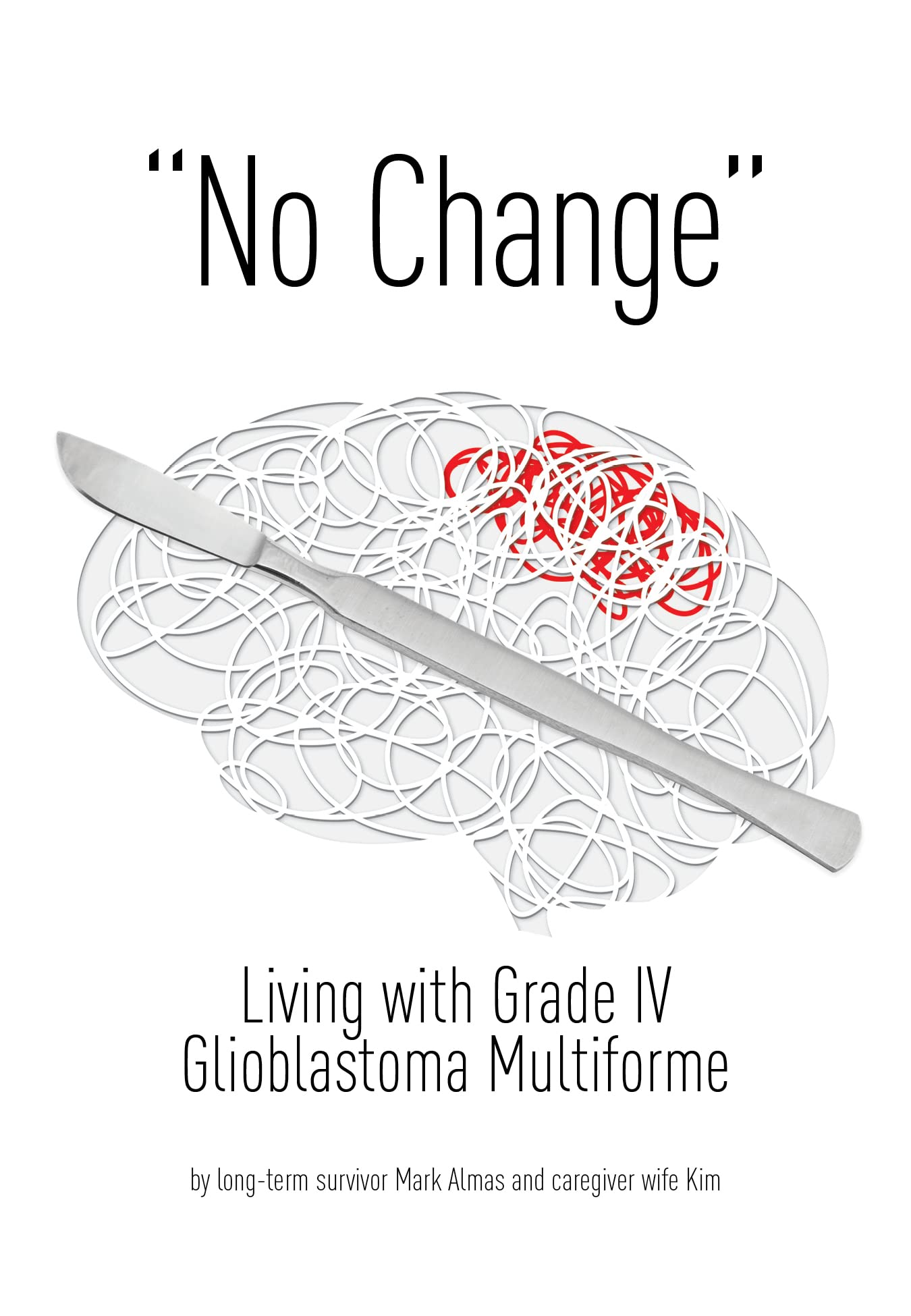 No Change: Living with Grade IV Glioblastoma Multiforme by Mark Almas ...