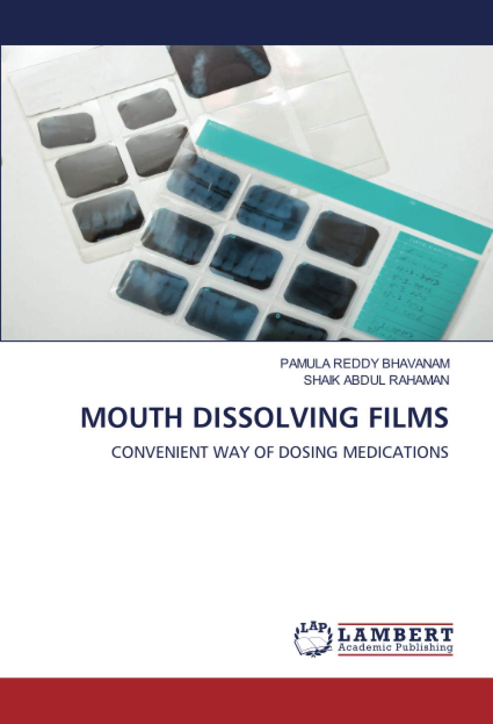 MOUTH DISSOLVING FILMS: CONVENIENT WAY OF DOSING MEDICATIONS by PAMULA ...