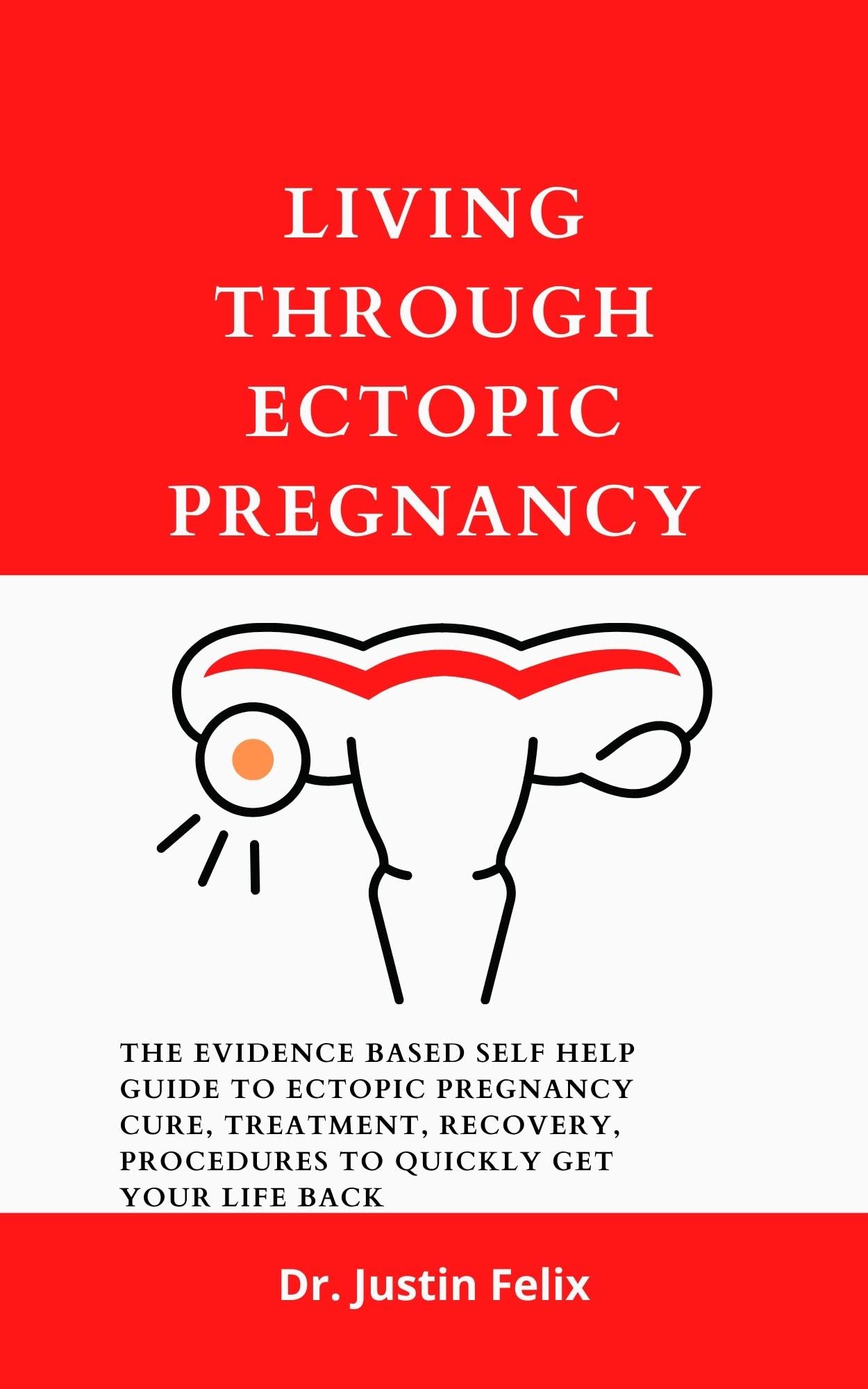 Living Through Ectopic Pregnancy : The Evidence Based Self Help Guide ...