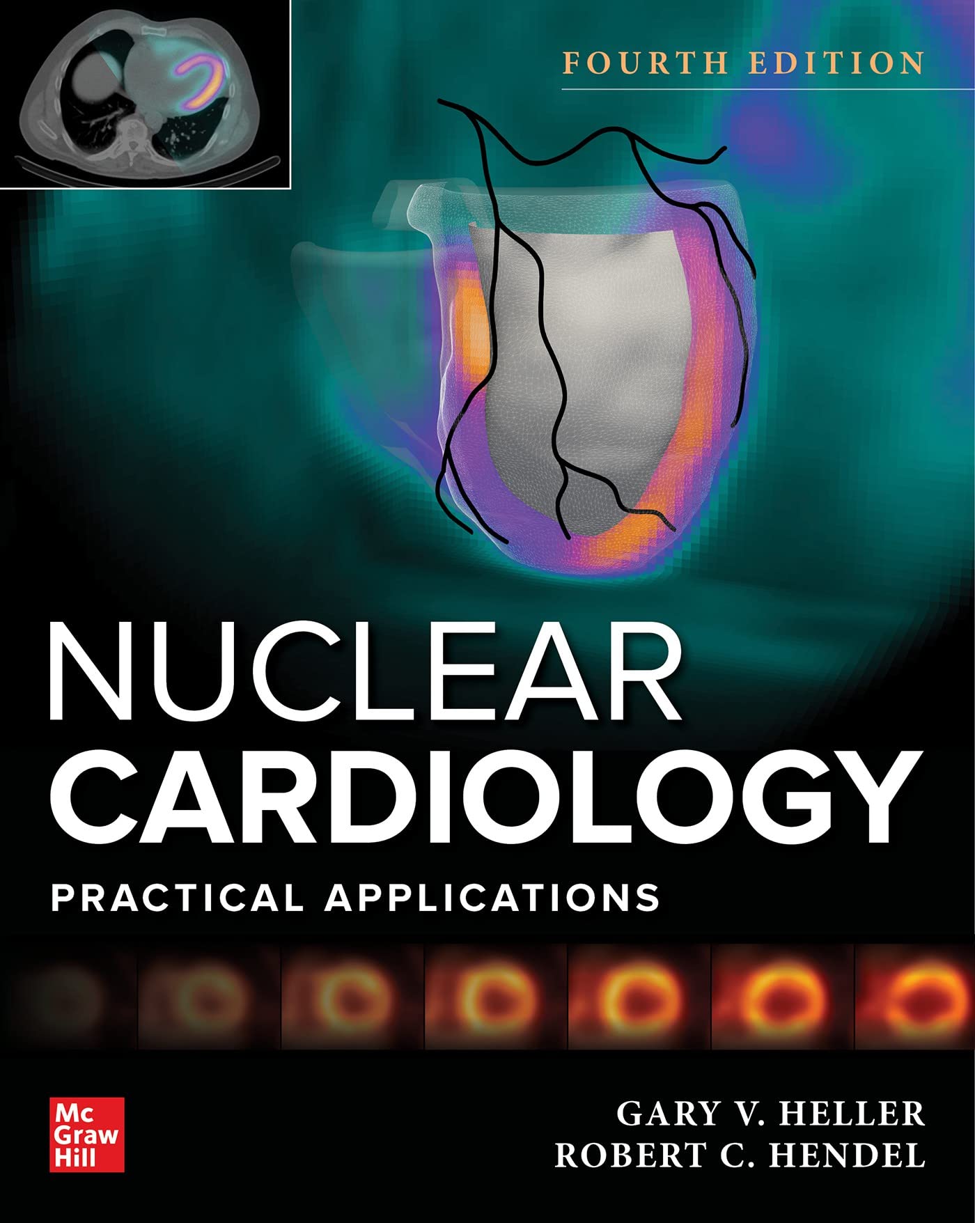 Nuclear Cardiology: Practical Applications, Fourth Edition by Gary V ...