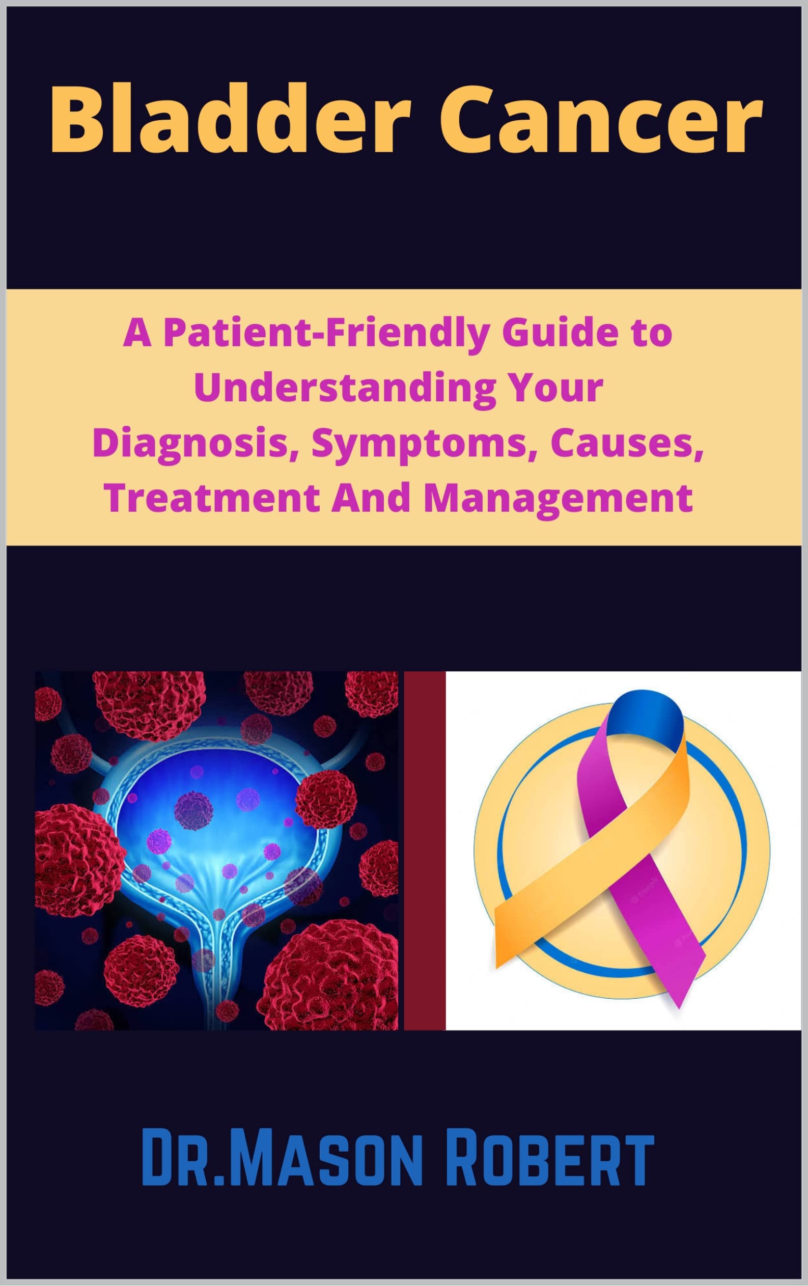 Bladder Cancer: A Patient-Friendly Guide To Understanding Your ...
