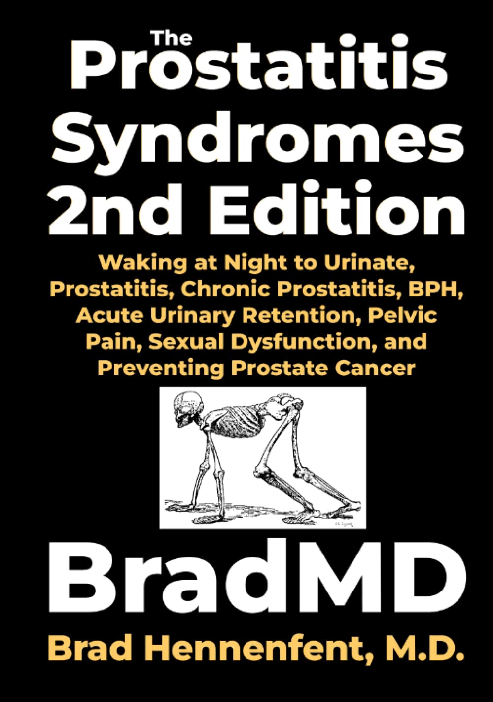 The Prostatitis Syndromes 2nd Edition: Waking at Night to Urinate ...