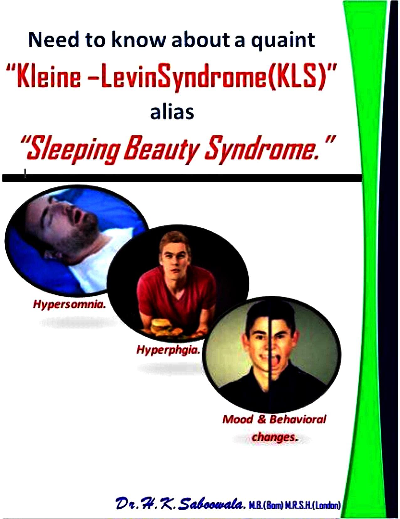 Need to know about a quaint “Kleine –Levin Syndrome” (KLS) alias ...