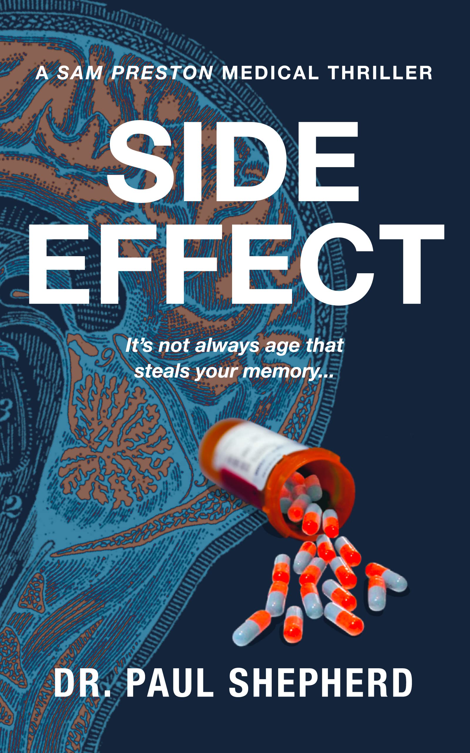 Side Effect: It's Not Always Age That Steals Your Memory by Paul ...