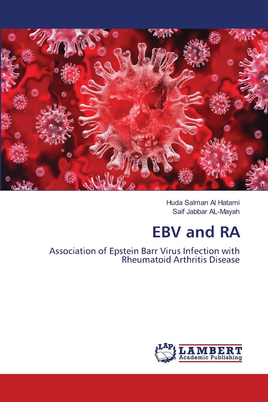 EBV and RA: Association of Epstein Barr Virus Infection with Rheumatoid ...