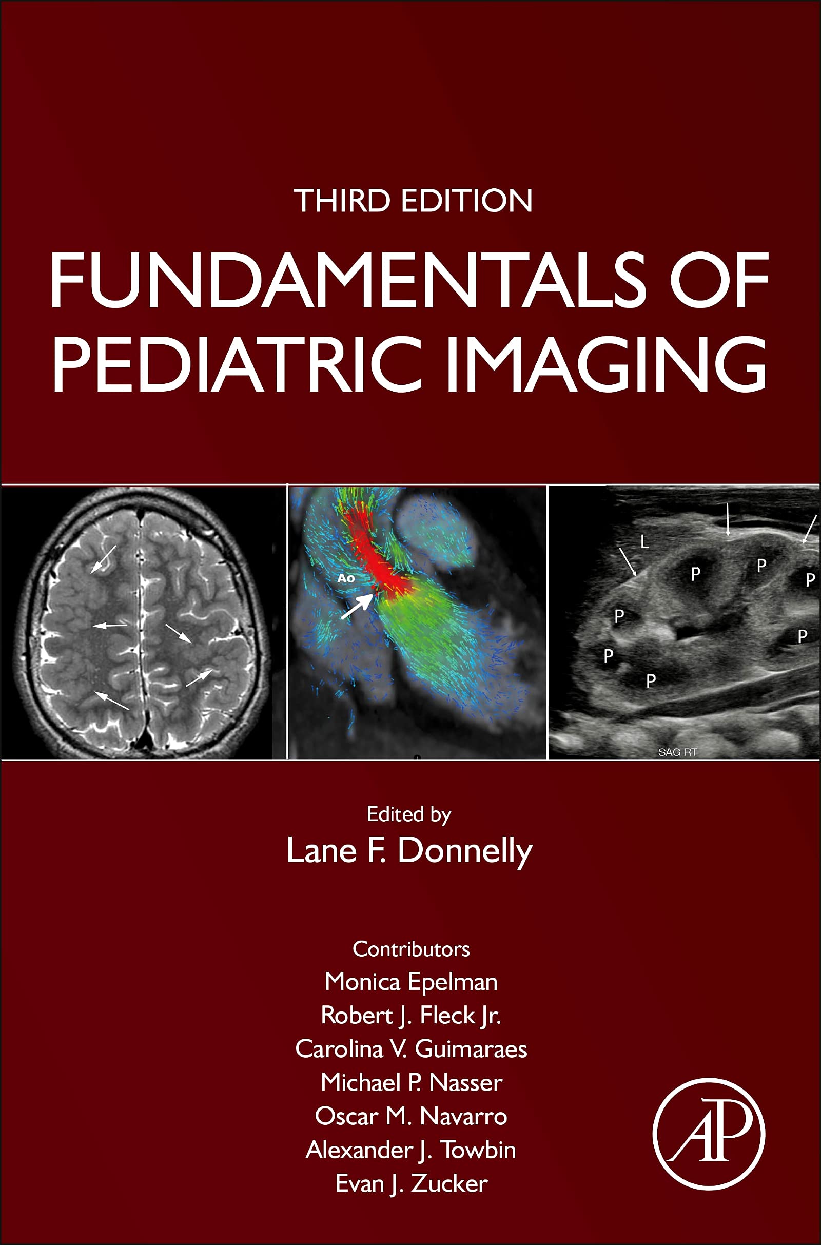 Fundamentals of Pediatric Imaging by Lane F. Donnelly | Goodreads