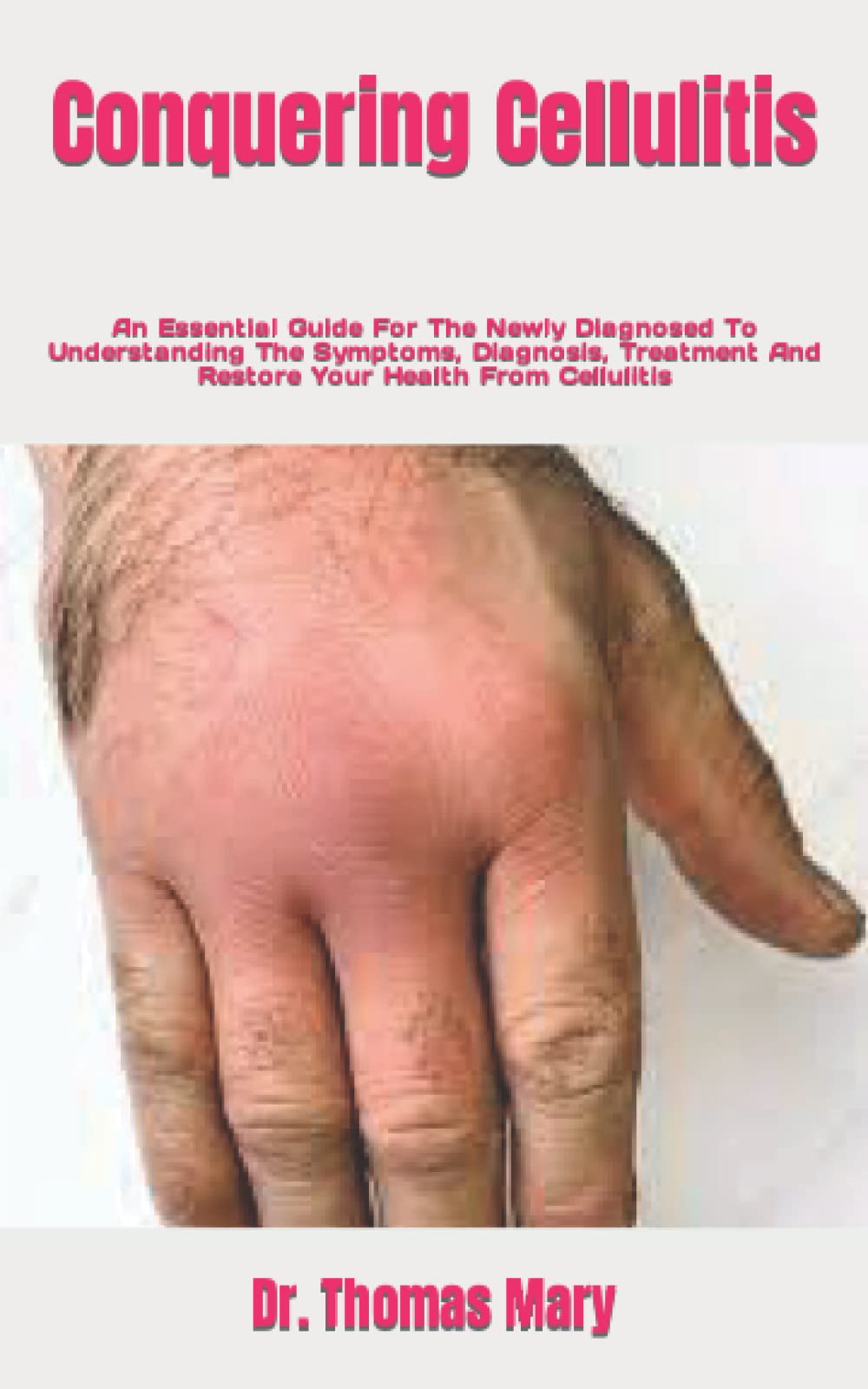 Conquering Cellulitis: An Essential Guide For The Newly Diagnosed To Understanding The Symptoms ...