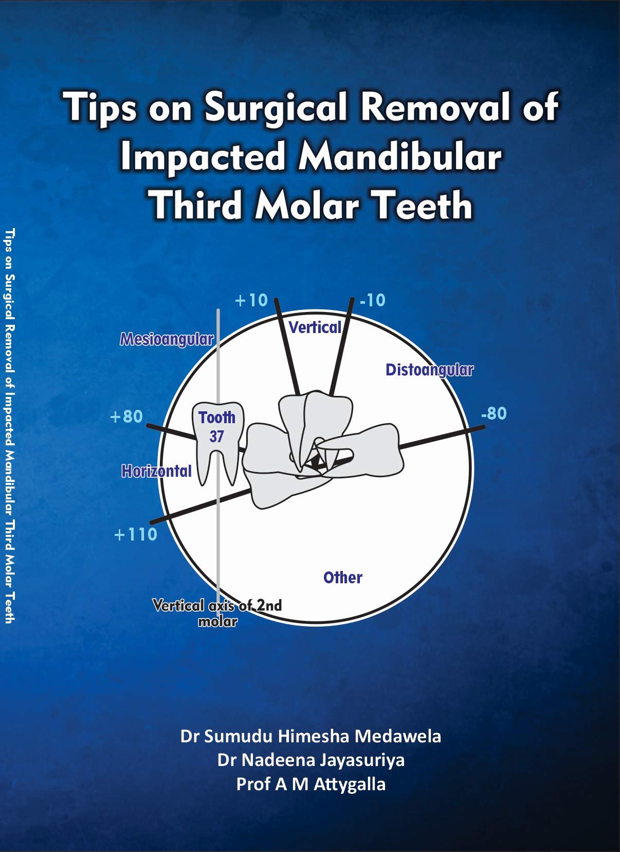 Tips on Surgical Removal of Impacted Mandibular Third Molar Teeth by R ...