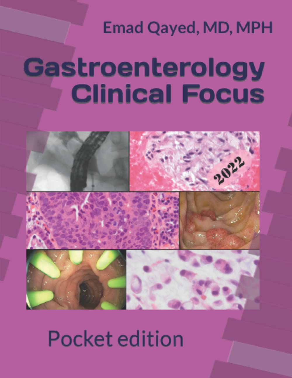 Gastroenterology Clinical Focus - Pocket edition: High yield GI and ...