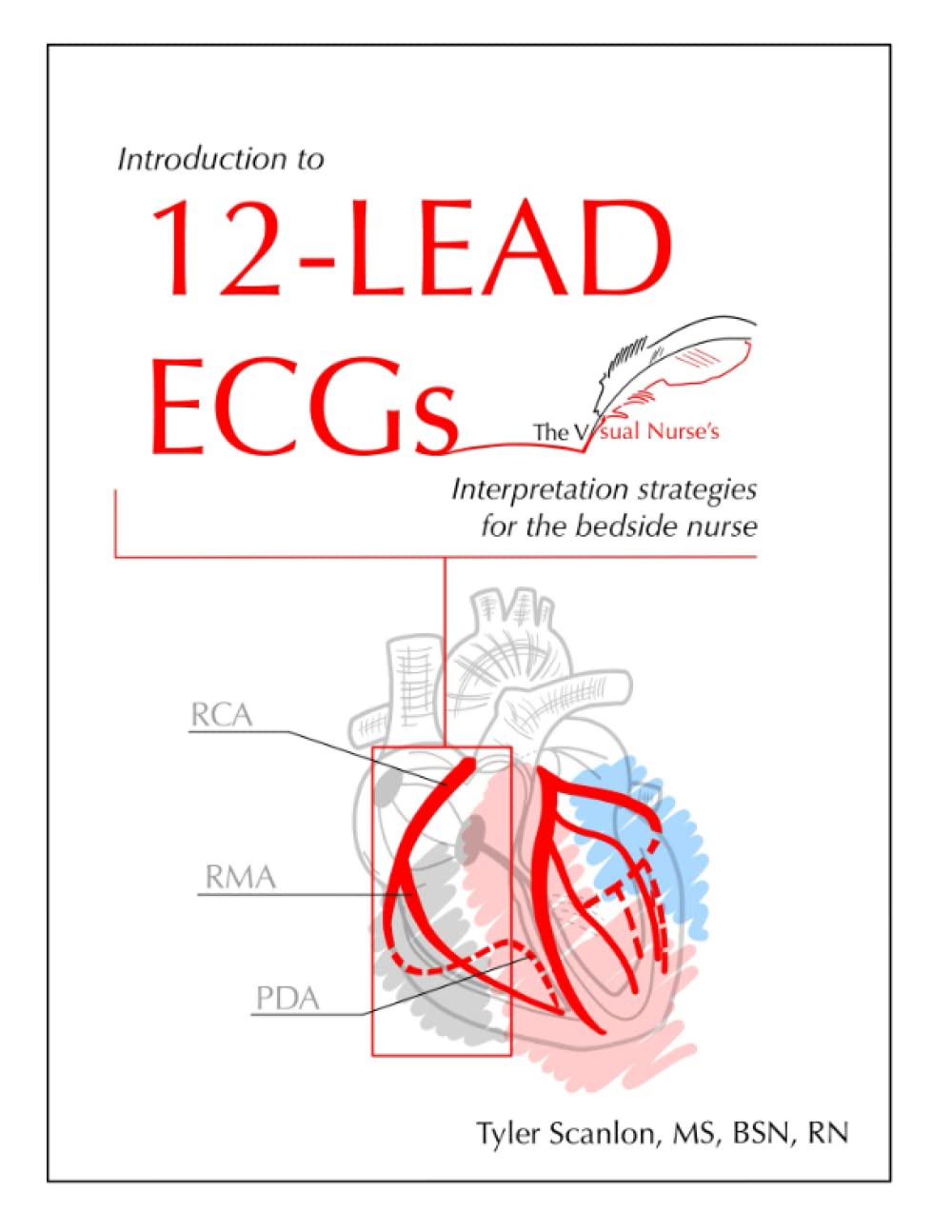Introduction to 12-Lead ECGs: Interpretation Strategies for The Bedside ...