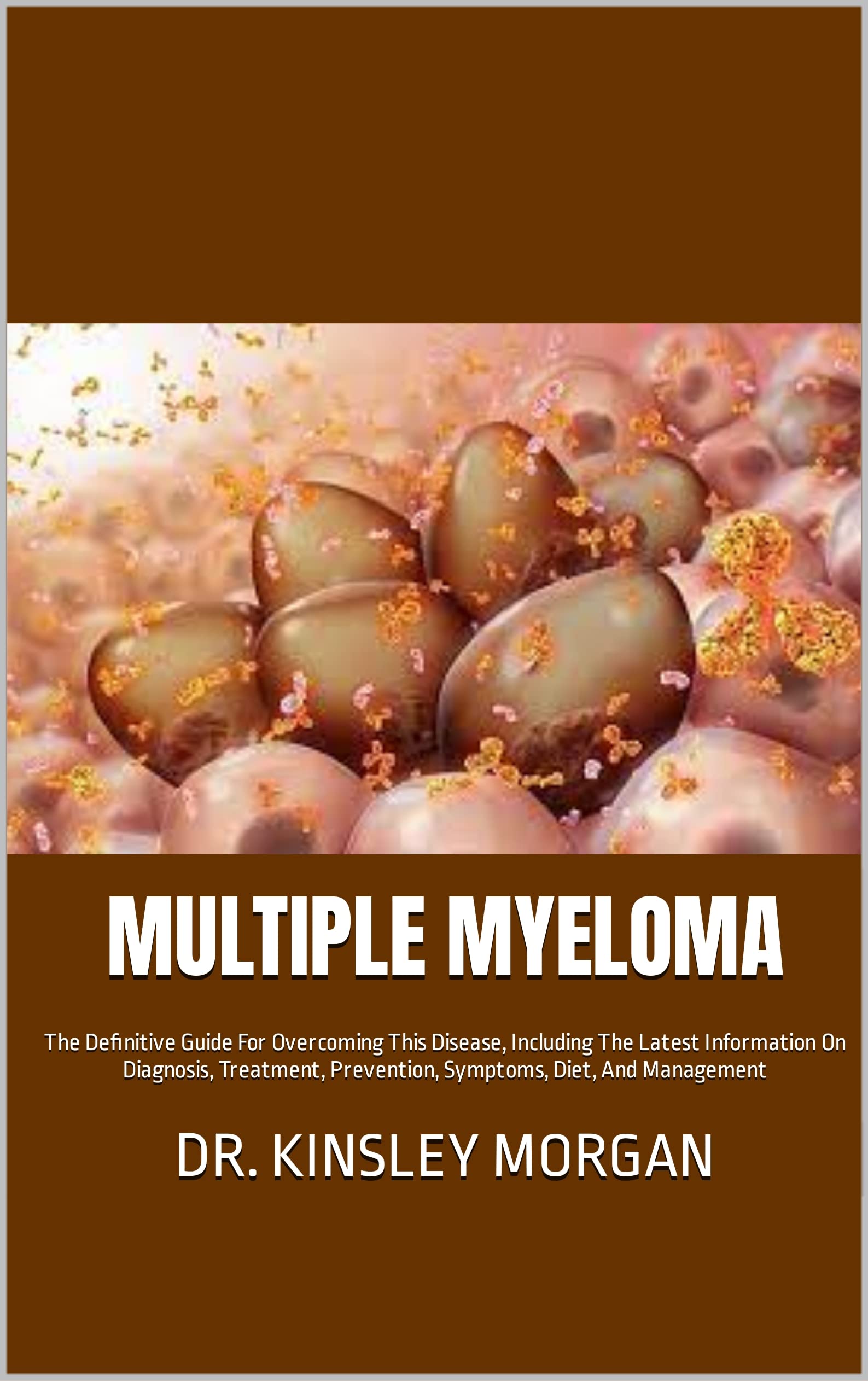 Multiple Myeloma : The Definitive Guide For Overcoming This Disease ...