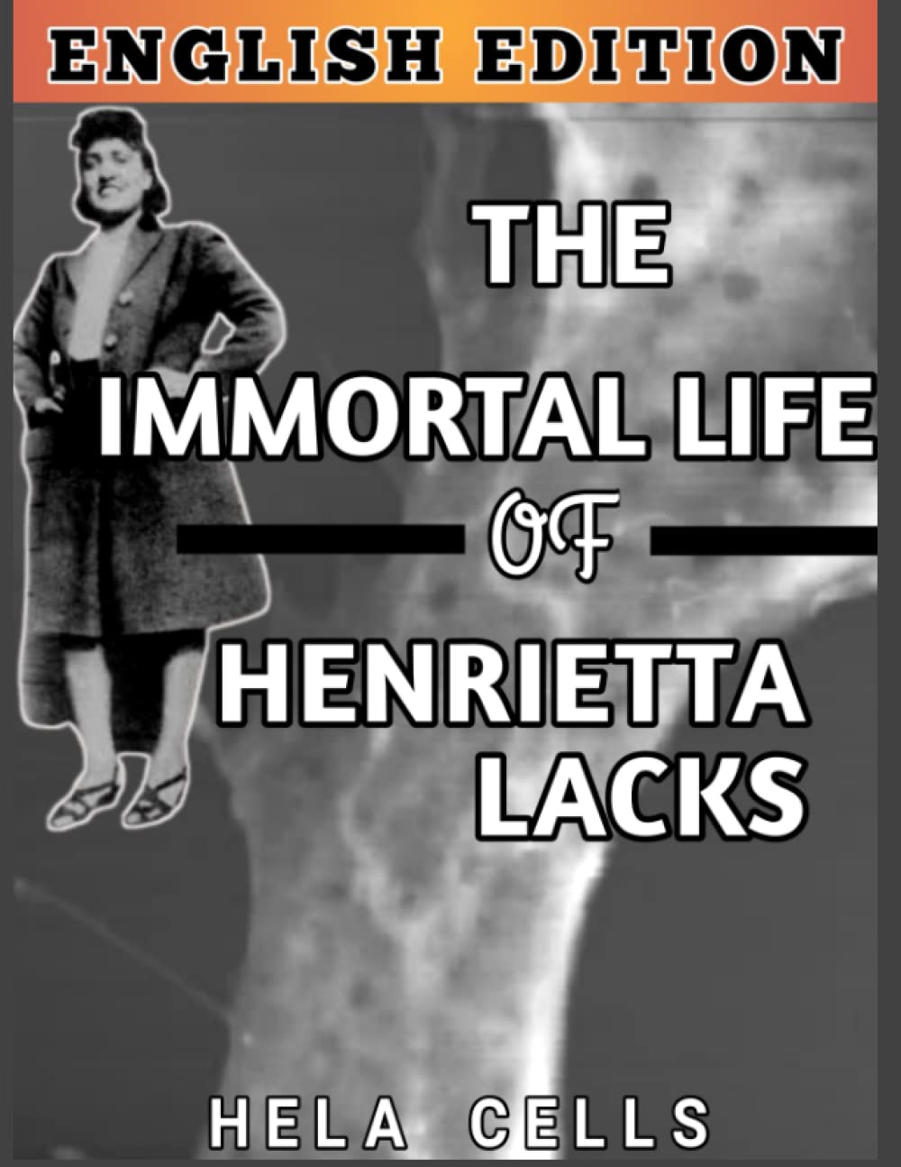 The Immortal Life Of Henrietta Lacks Hela Cells by Rebecca Owens | Goodreads