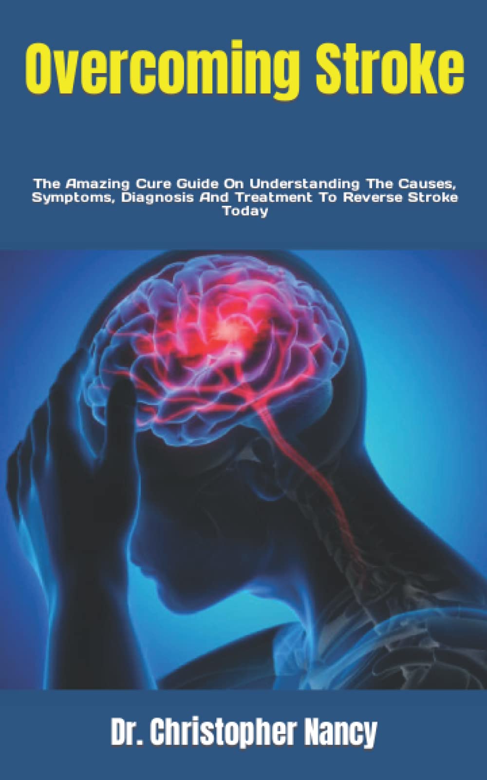 Overcoming Stroke: The Amazing Cure Guide On Understanding The Causes ...