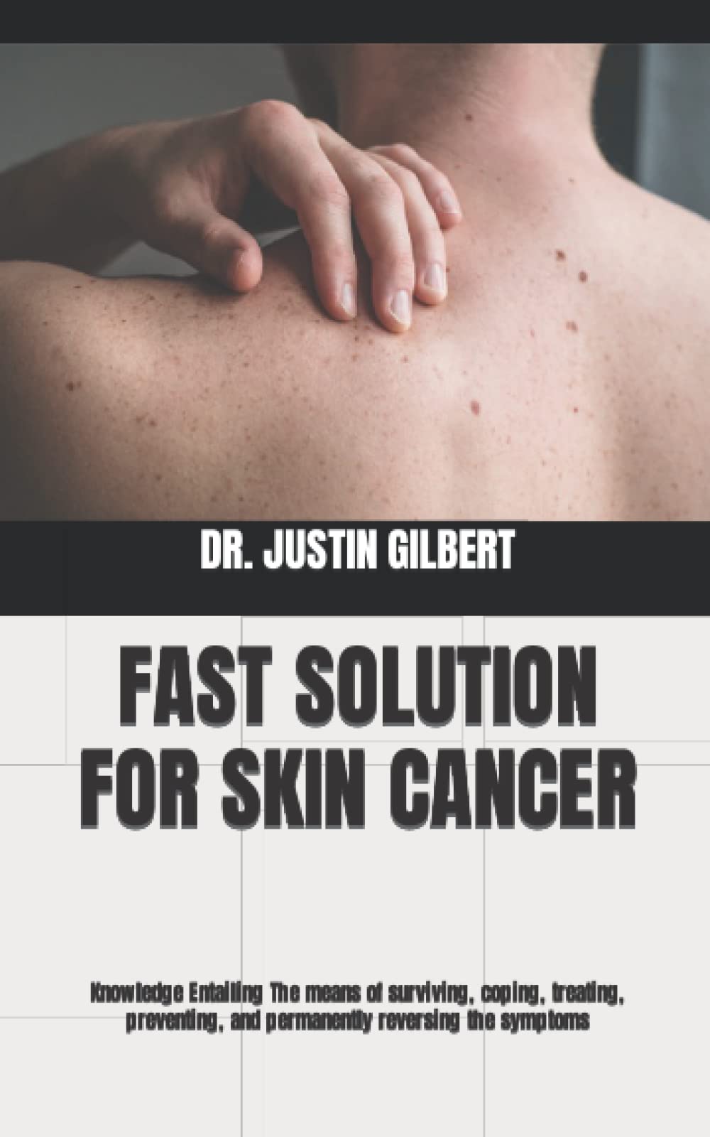 FAST SOLUTION FOR SKIN CANCER: Knowledge Entailing The means of ...