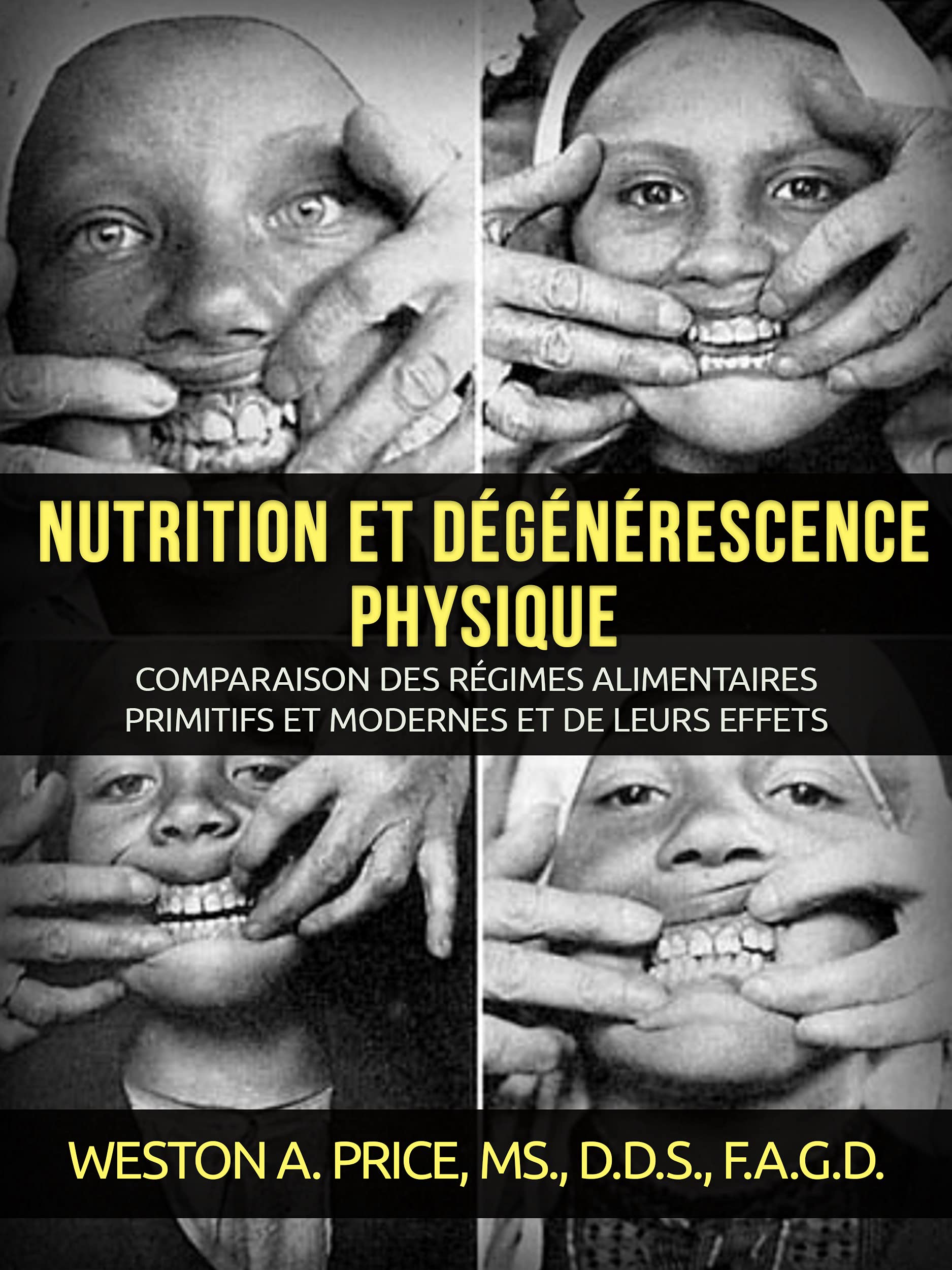 Nutrition et dégénérescence physique (Traduit) by Weston A. Price ...