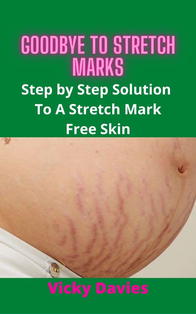 Goodbye To Stretch Marks: Step by Step Solution to Stretch Mark Free ...