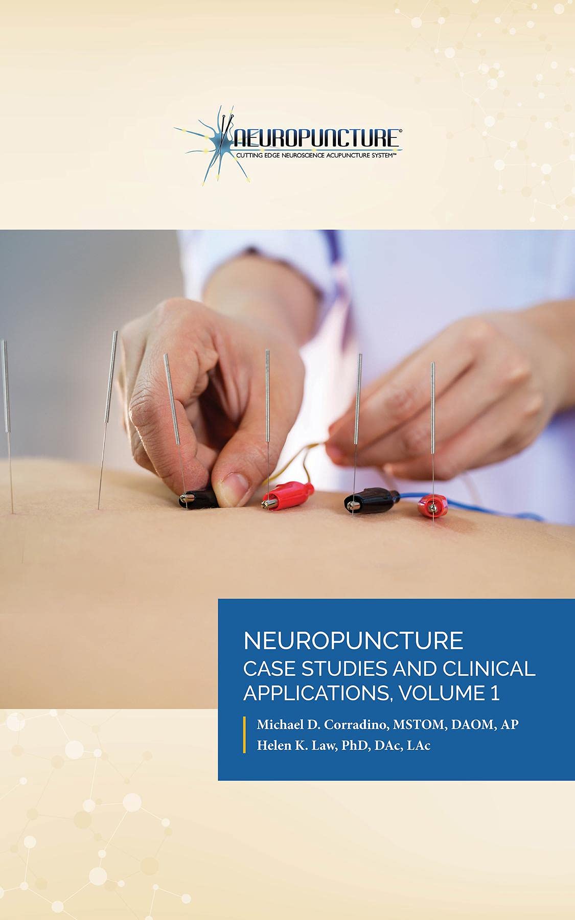 Neuropuncture™ Case Studies and Clinical Applications: Volume 1 by Dr. Michael Corradino | Goodreads