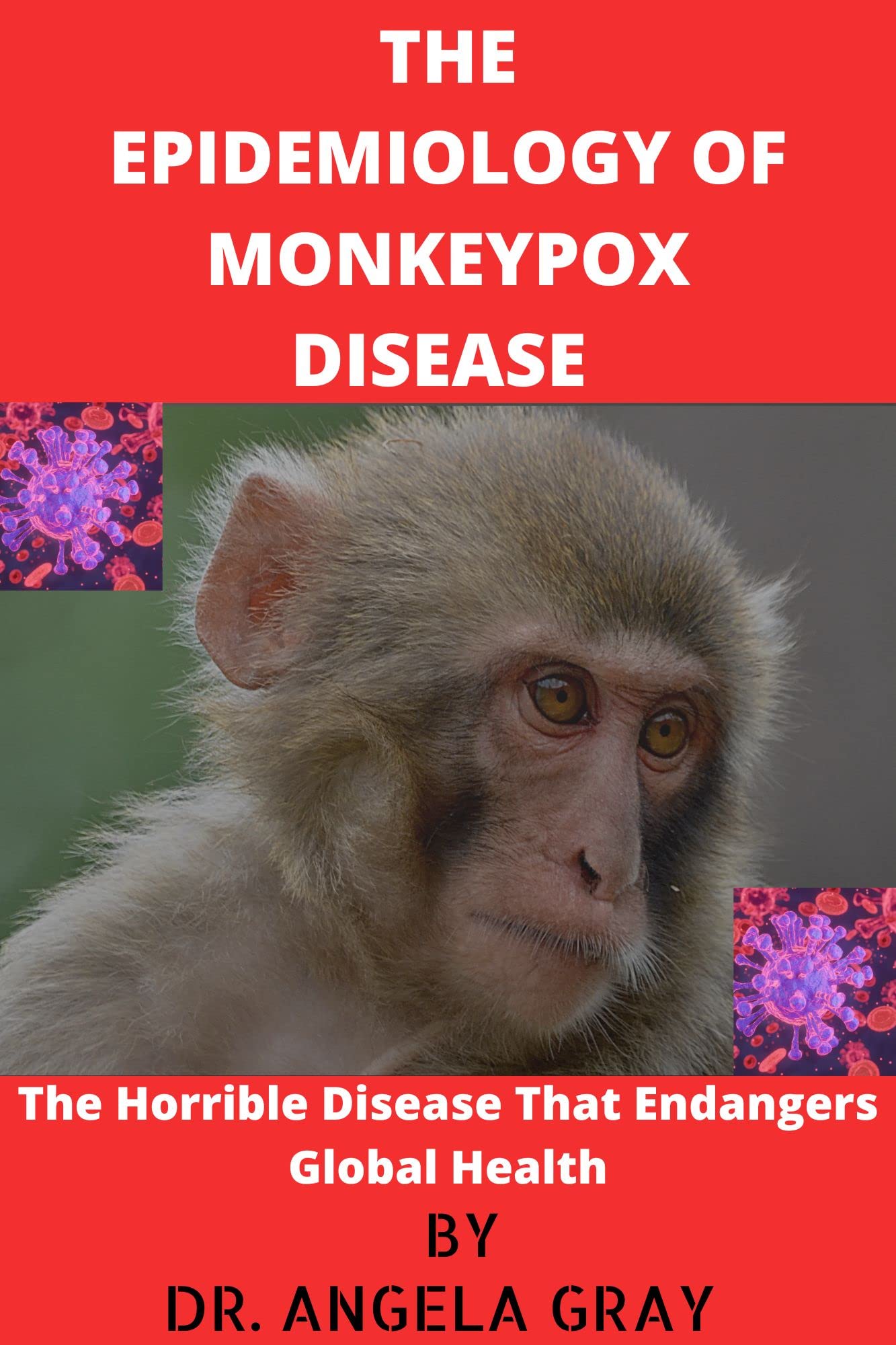 THE EPIDEMIOLOGY OF MONKEYPOX DISEASE : The Horrible Disease That ...