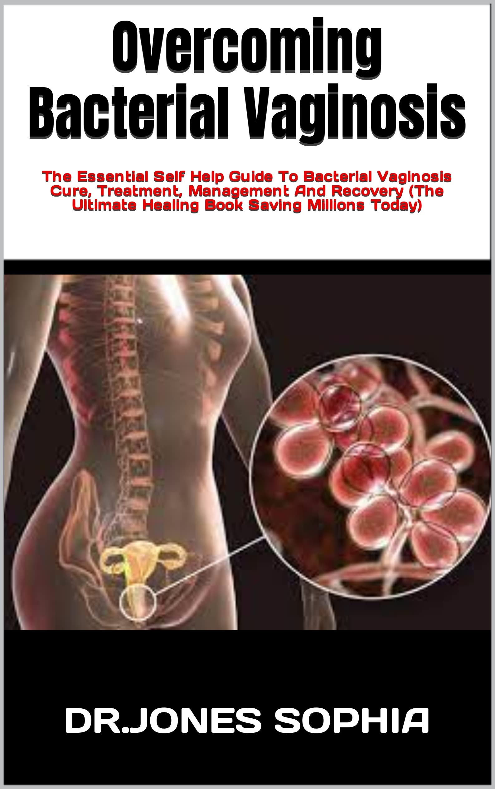 Overcoming Bacterial Vaginosis : The Essential Self Help Guide To Bacterial Vaginosis Cure ...