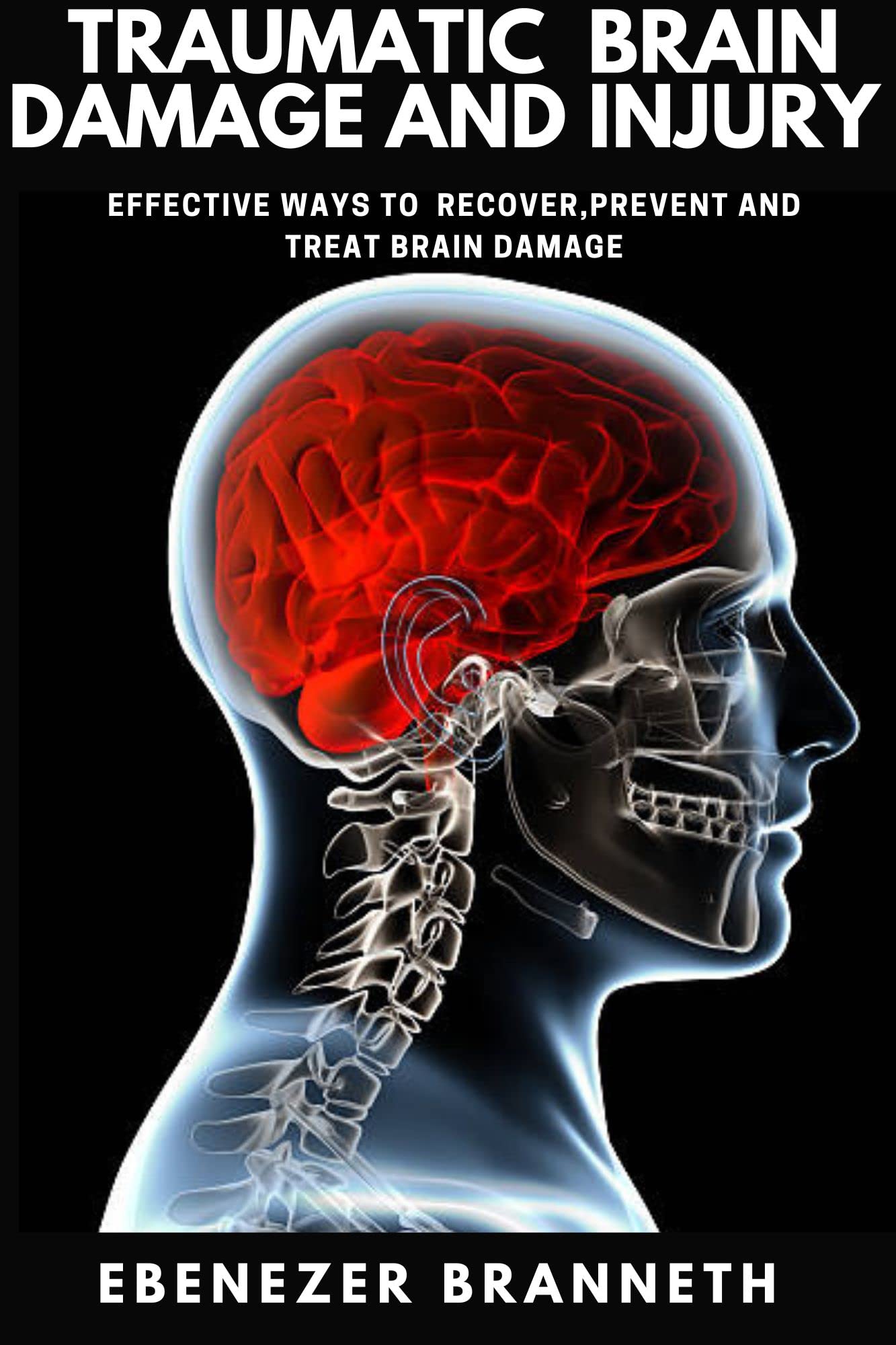 Traumatic Brain damage and injury : Effective ways to recover, prevent ...