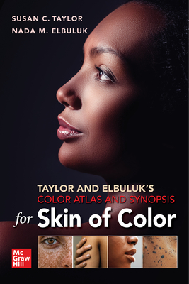 TAYLOR AND ELBULUK'S COLOR ATLAS AND SYNOPSIS FOR SKIN OF COLOR by ...