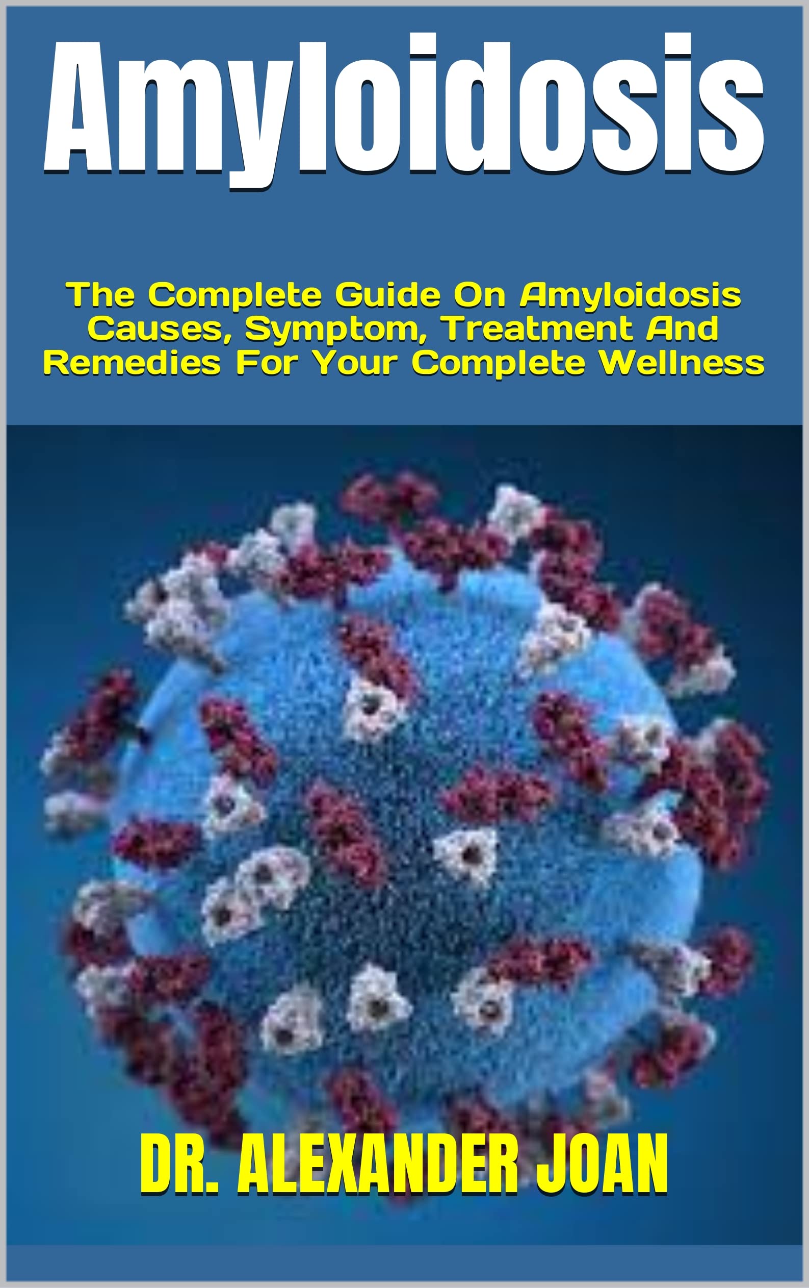 Amyloidosis : The Complete Guide On Amyloidosis Causes, Symptom ...
