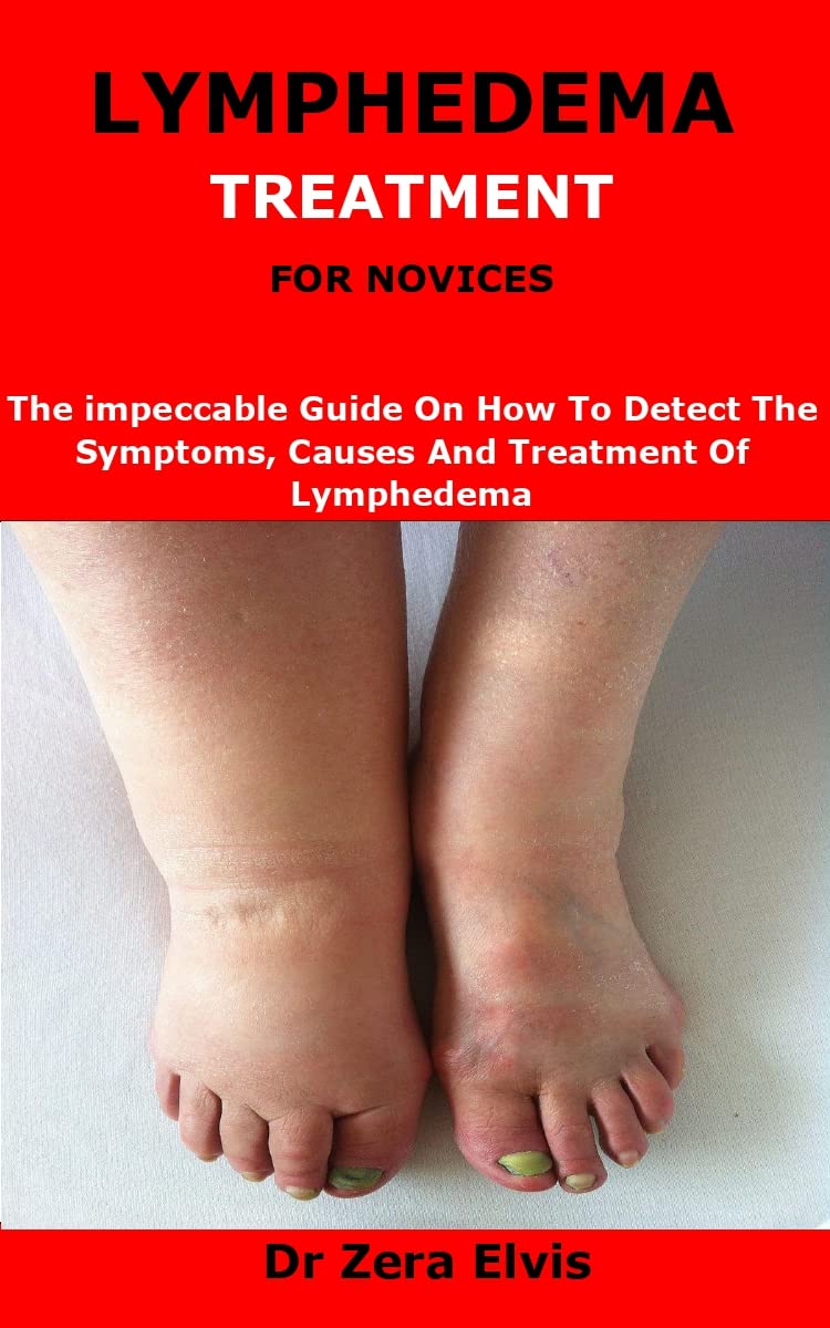 LYMPHEDEMA TREATMENT FOR NOVICES: The impeccable Guide On How To Detect ...